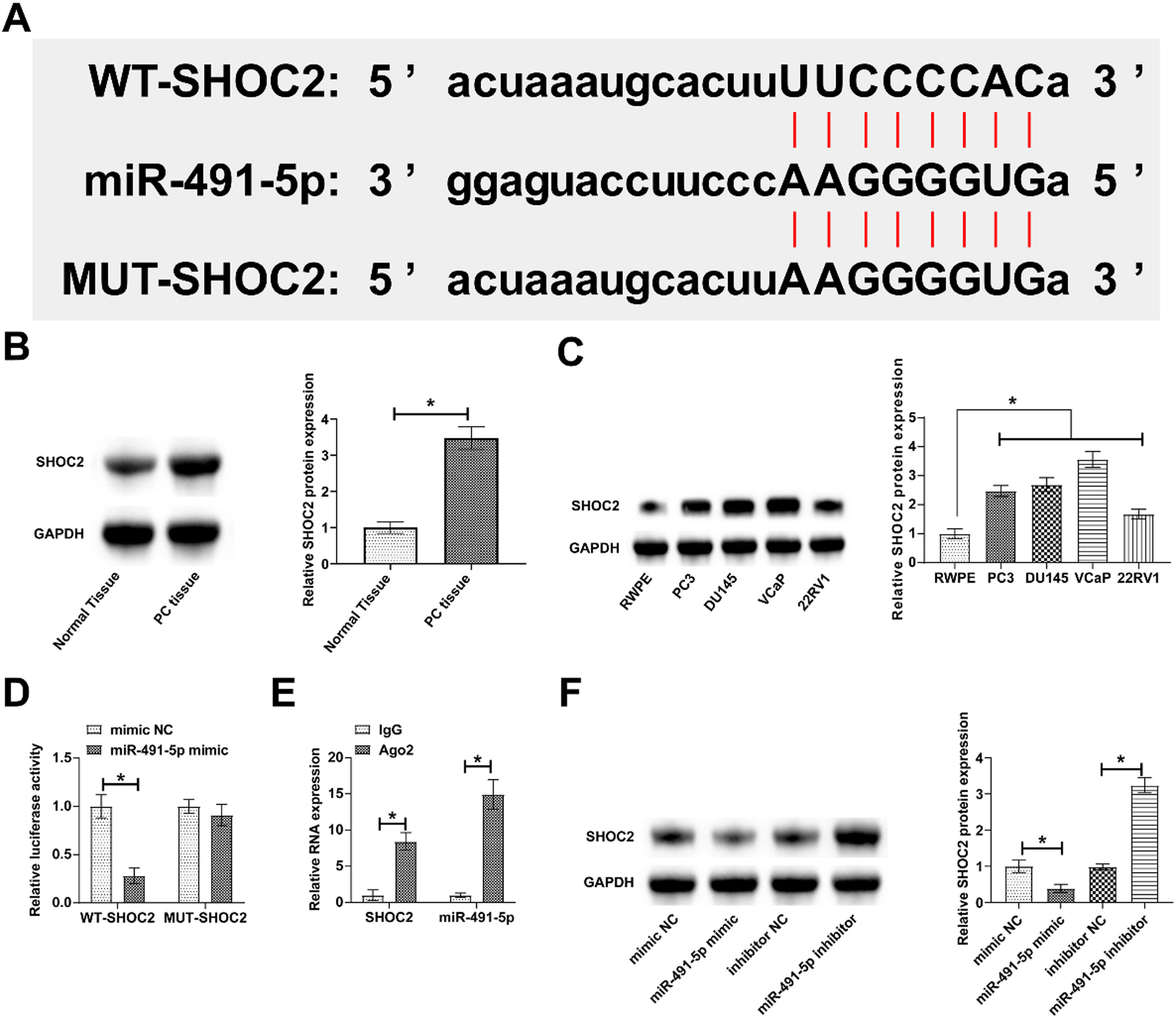 circCPA4 induces malignant behaviors of prostate cancer via miR-491-5p ...