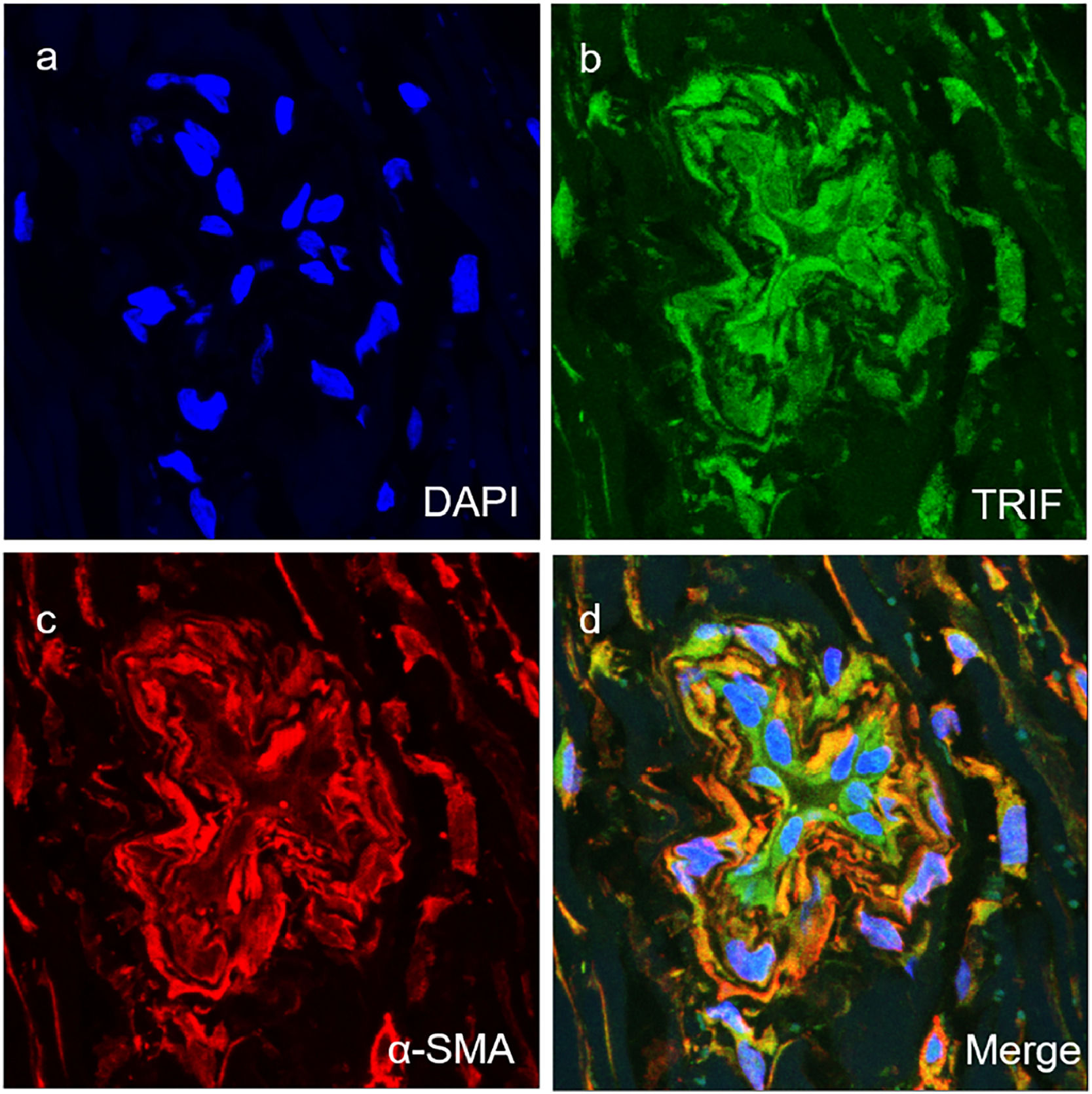 Toll-like receptor signaling pathway involved in pathogenesis of ...
