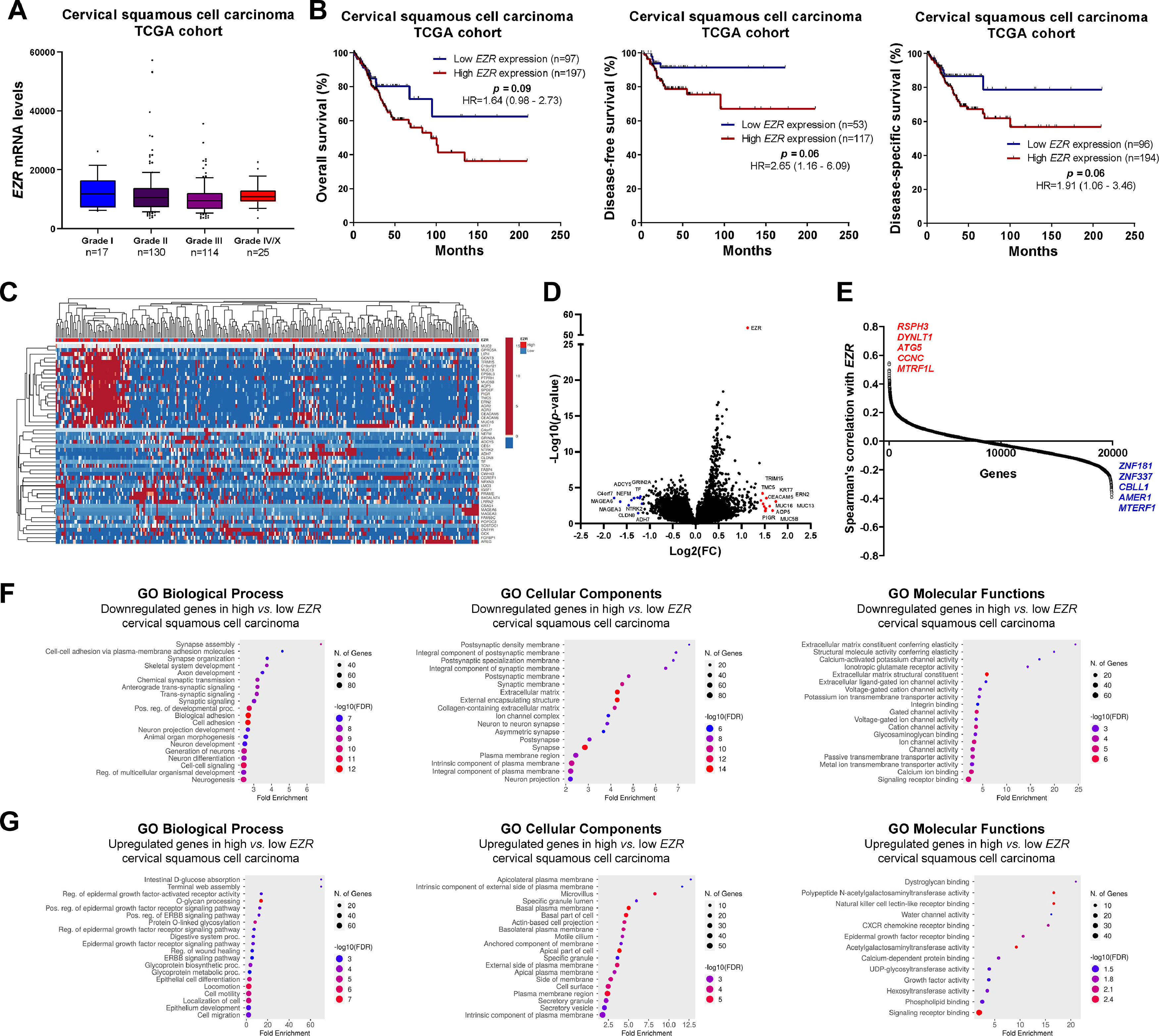 Transcriptomics analysis identified ezrin as a potential druggable ...