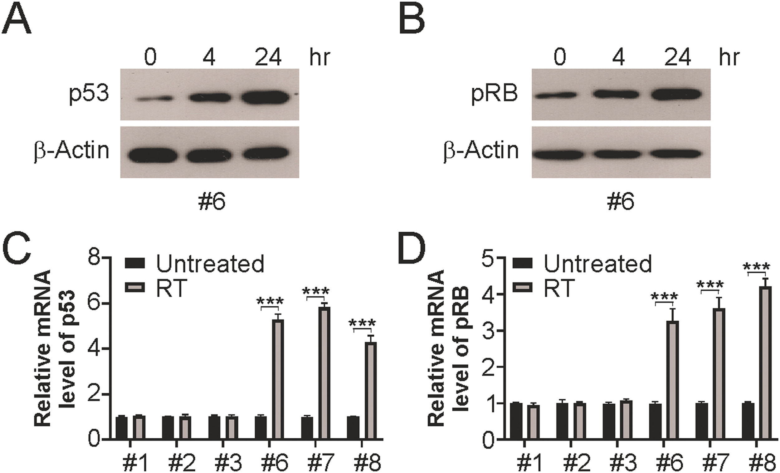 P53 and pRB induction improves response to radiation therapy in HPV ...