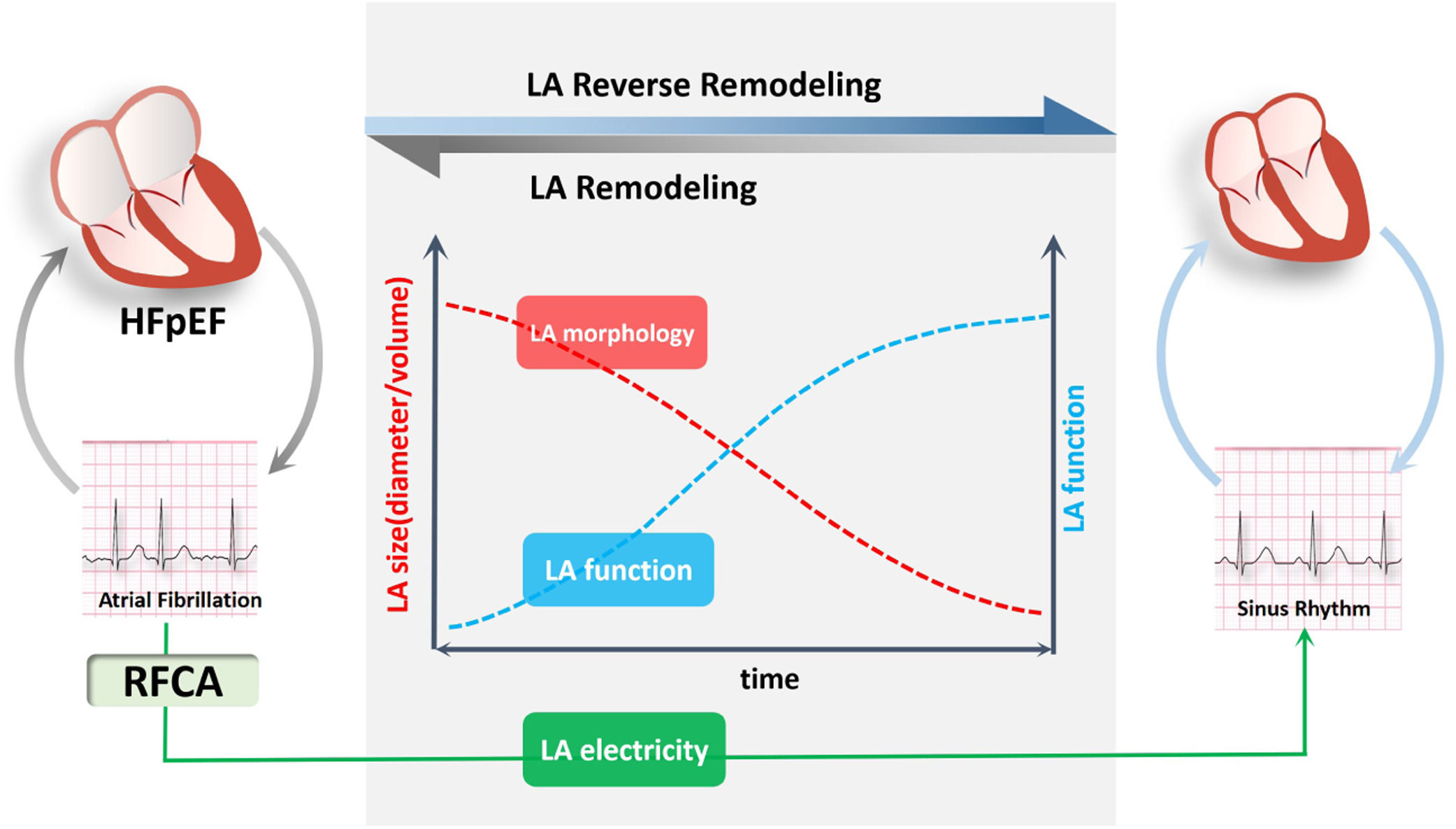 Left atrial reverse remodeling in patients with persistent atrial ...