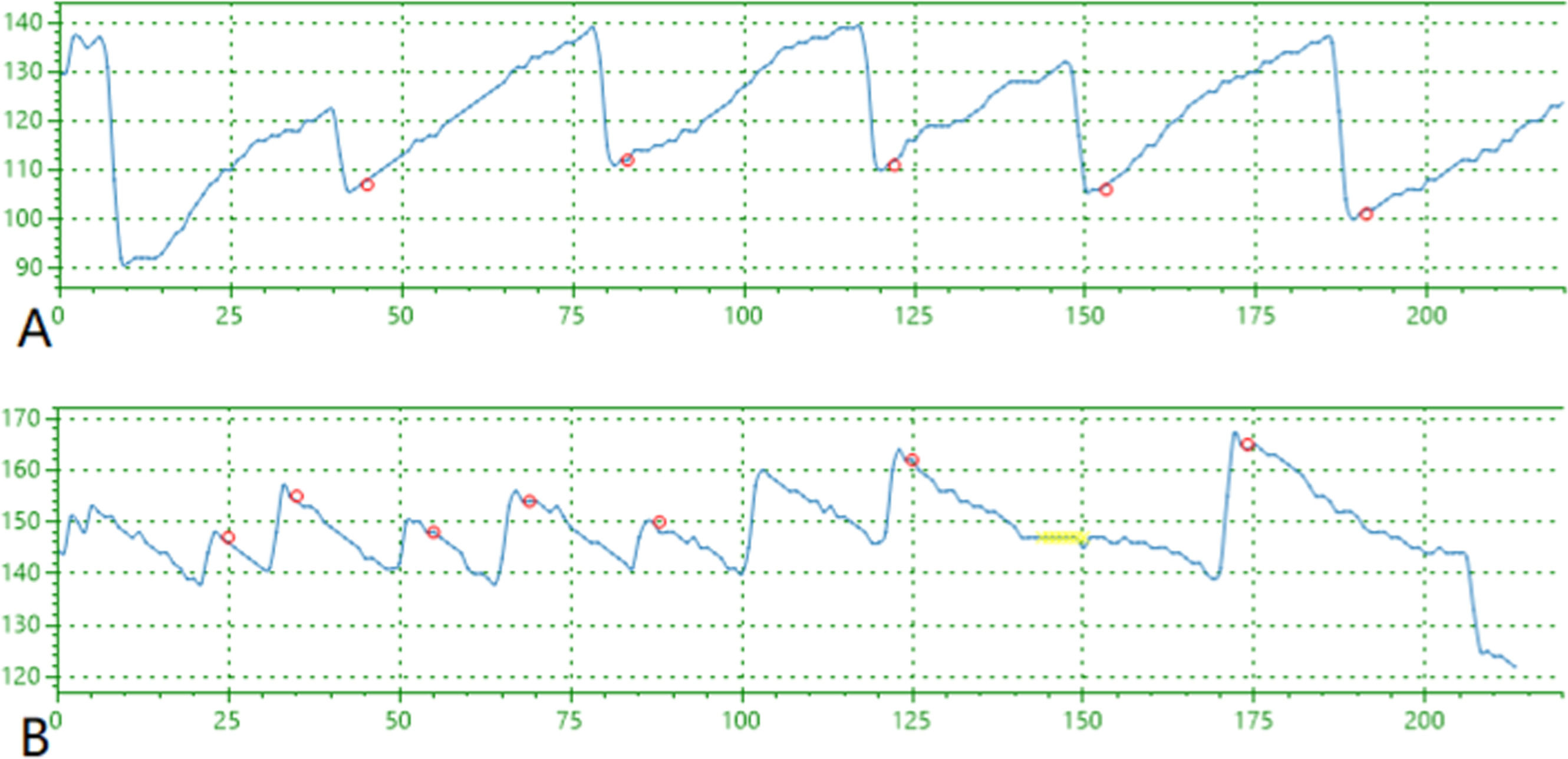 Assessing pediatric visual acuity with a computerized optokinetic ...