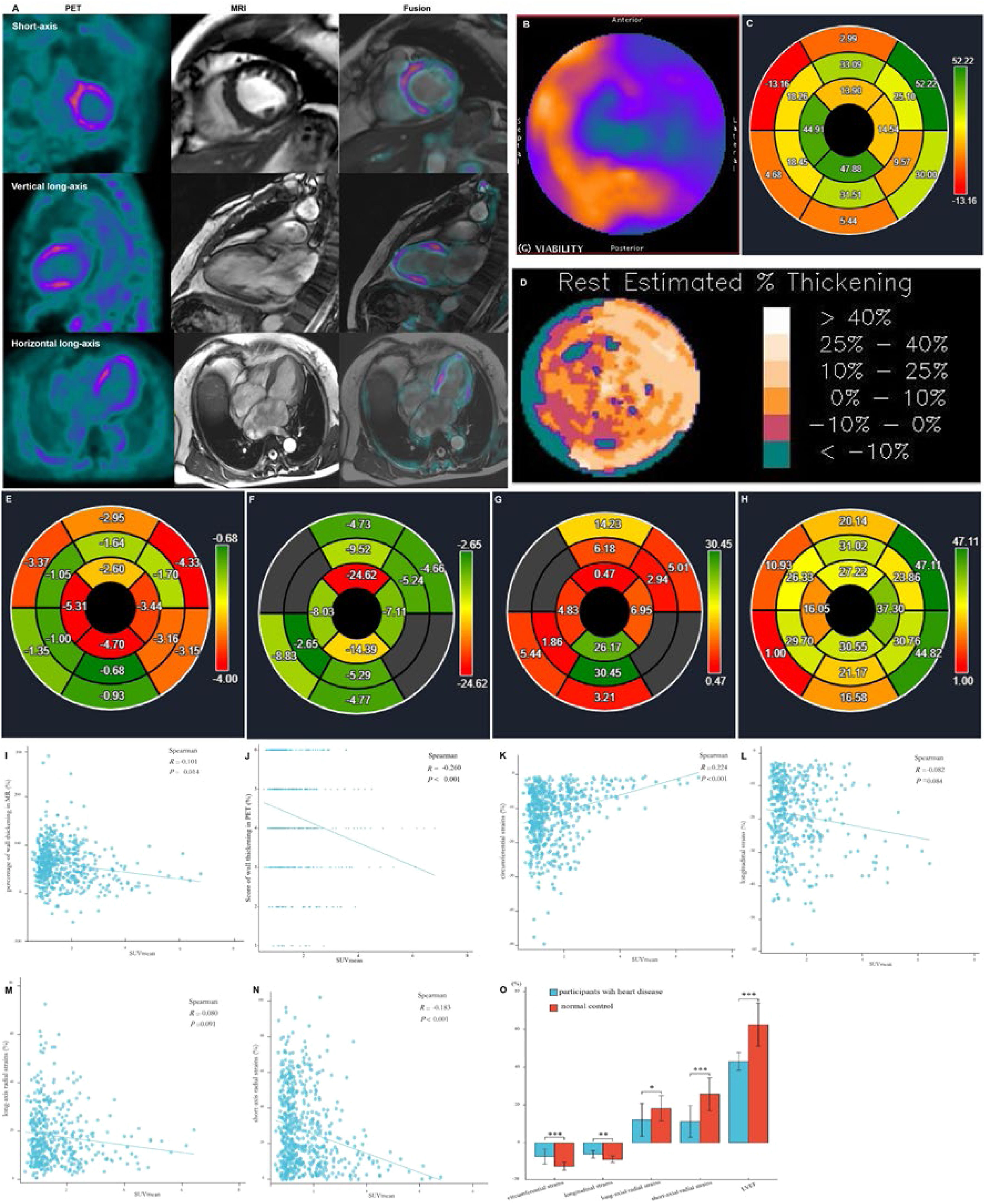 Simultaneous 18F-labeled AlF-FAPI PET/MR images targeting the ...