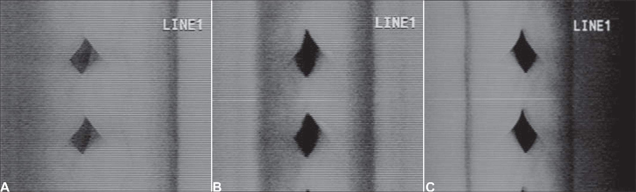 The influence of the position of the laryngeal endoscope laryngeal on ...