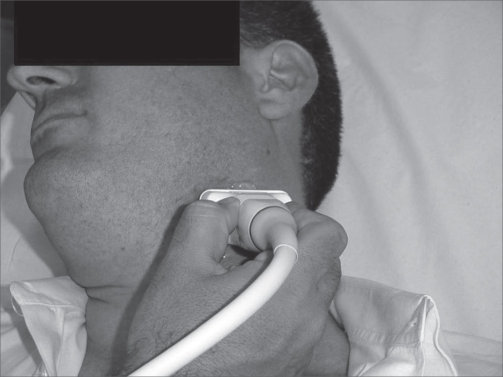 Intraoral and transcutaneous cervical ultrasound in the differential ...