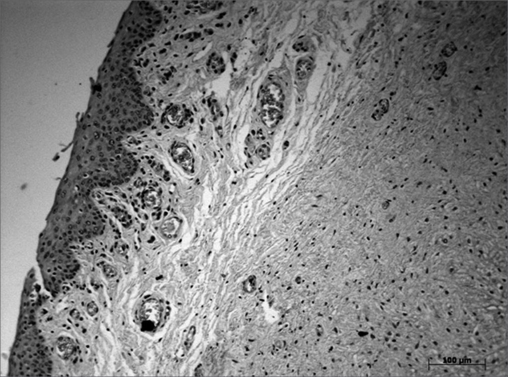 Detection of Hyaluronic Acid Receptor in Human Vocal Folds by ...