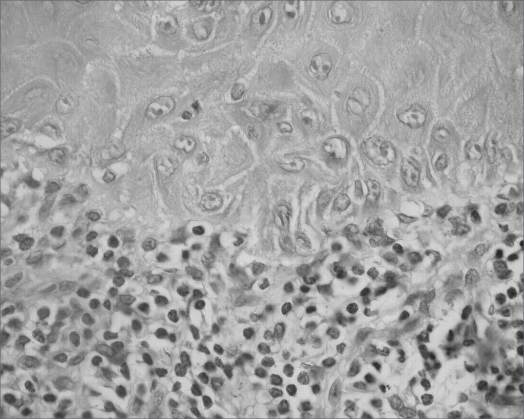 lichen under microscope 400x