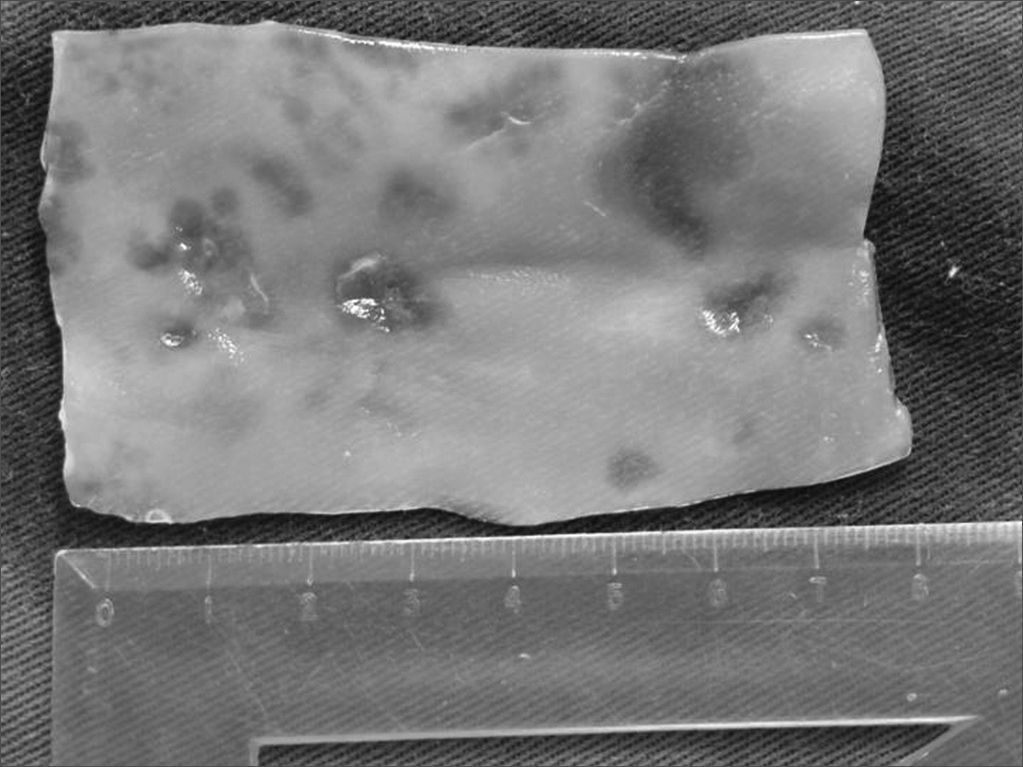 Experimental study of the tissue reaction caused by the presence of ...