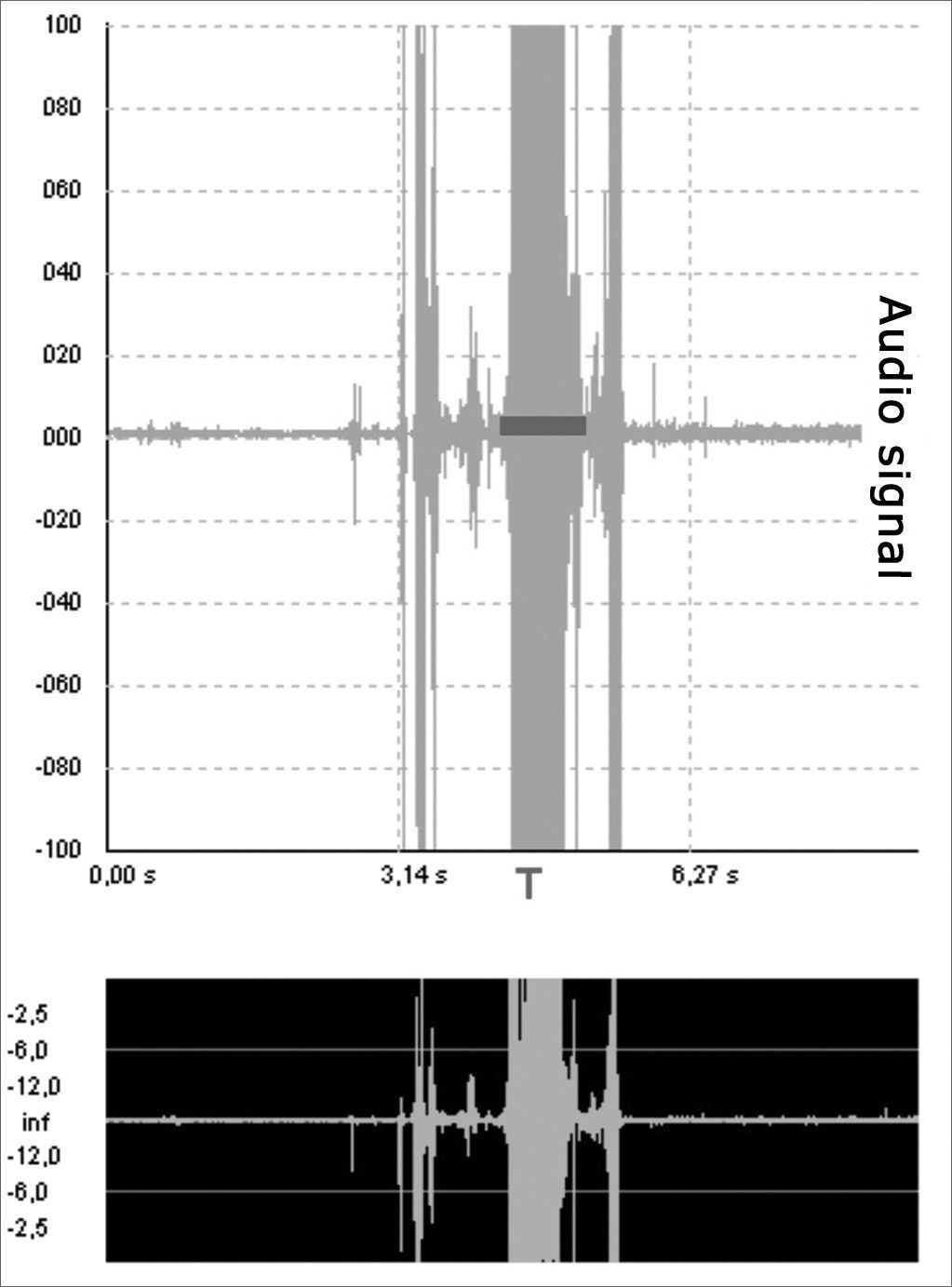 Doppler sonar analysis of swallowing sounds in normal pediatric ...
