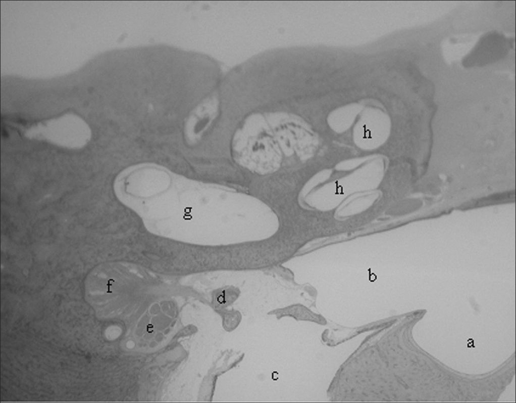 Histology of sheep temporal bone | Brazilian Journal of Otorhinolaryngology
