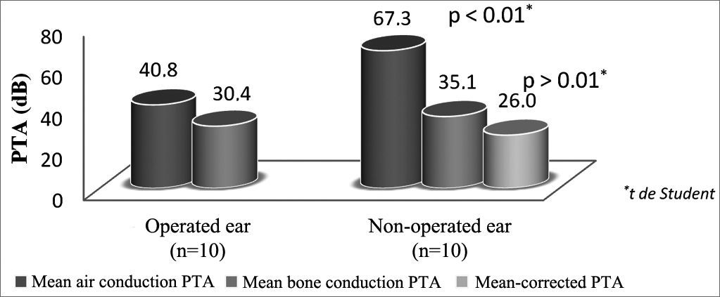 Long term outcome of otosclerosis surgery | Brazilian Journal of ...