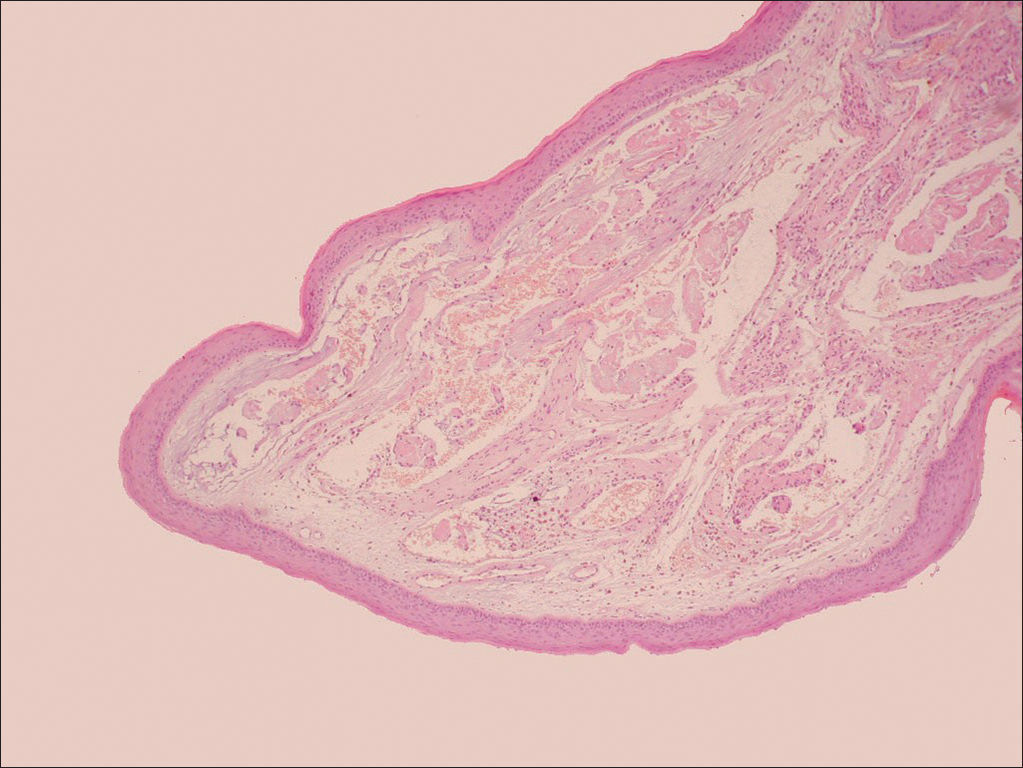 cord pathology