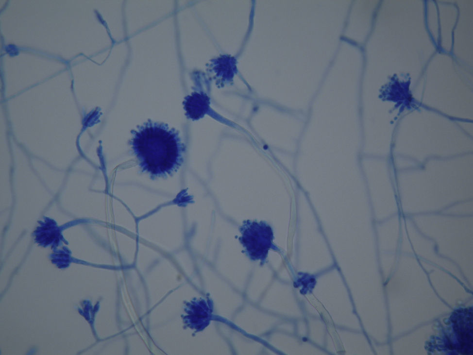 aspergillus niger microscope