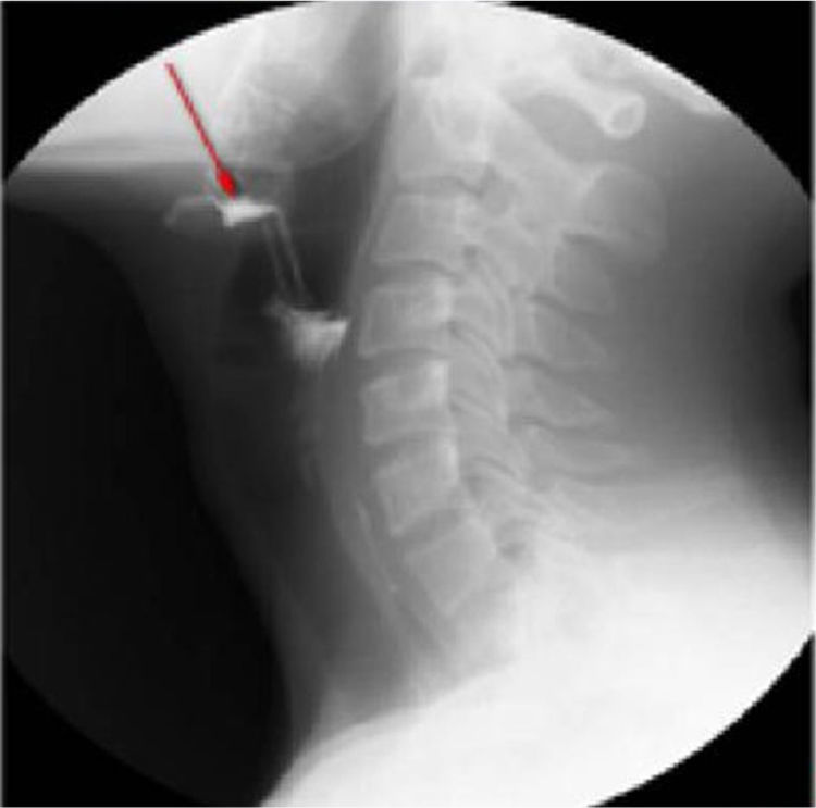 Clinical characteristics for conservative therapy of pediatric ...
