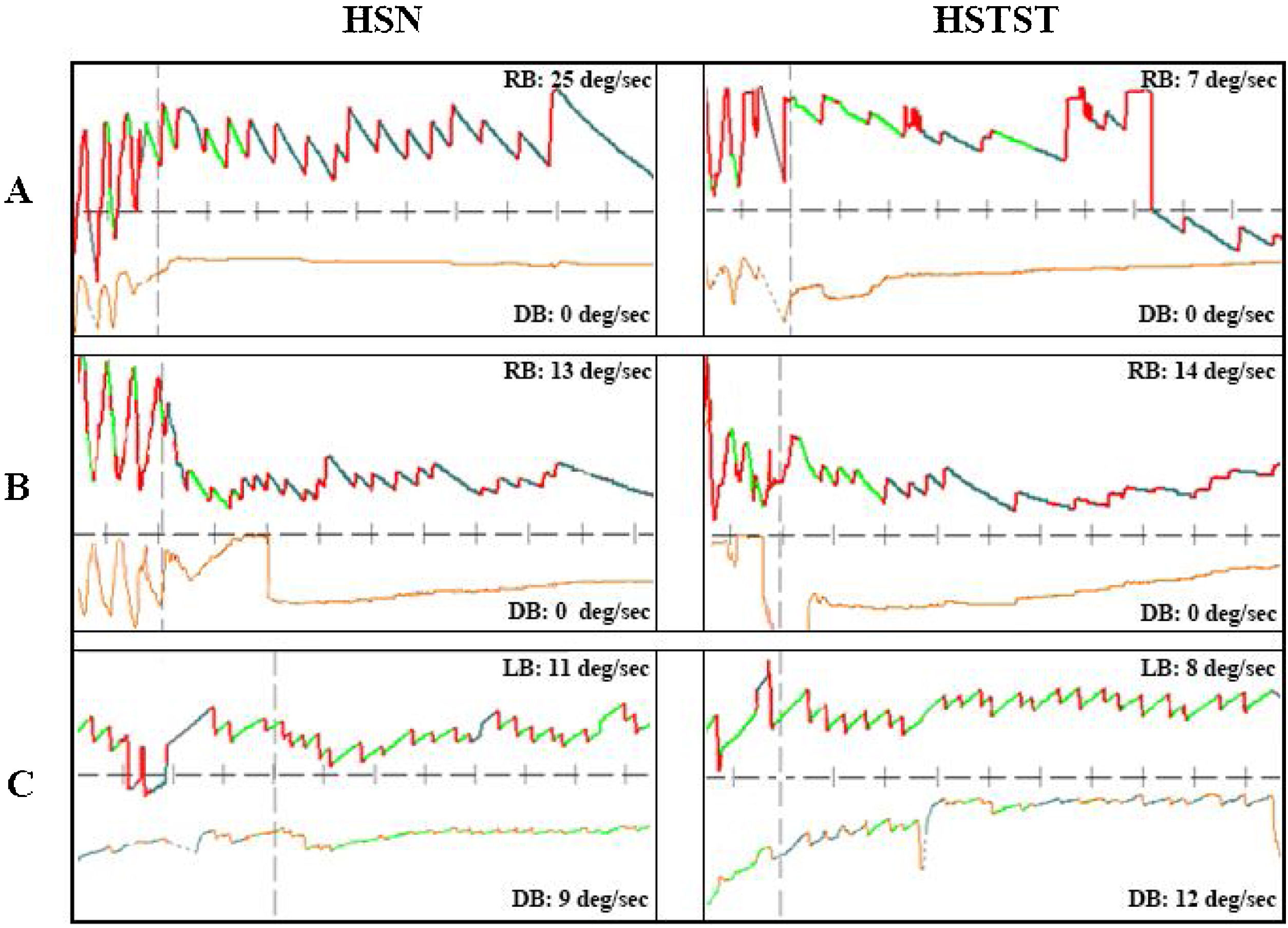 The clinical application of head-shaking test combined with head ...