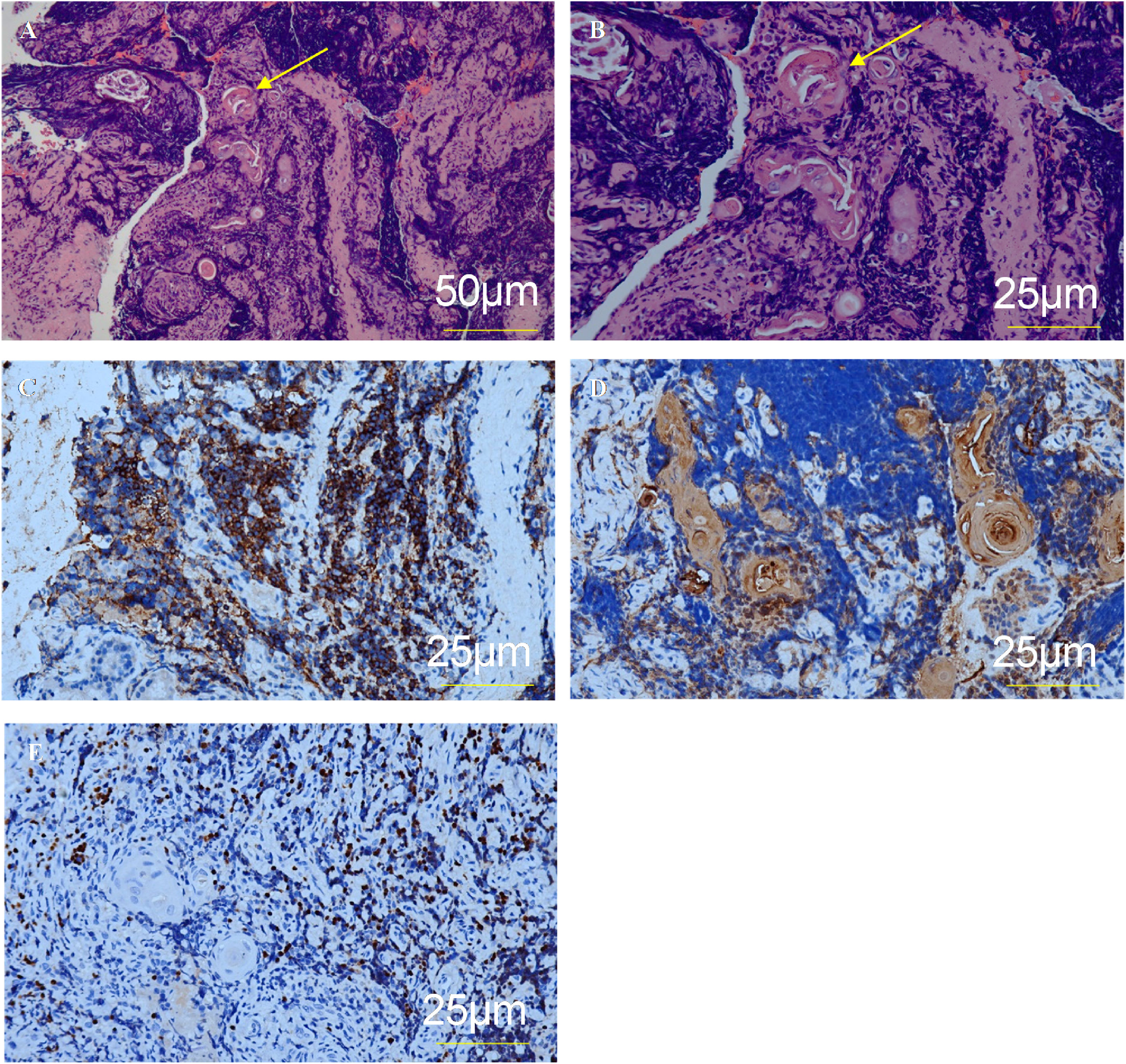 thymus starry sky pattern