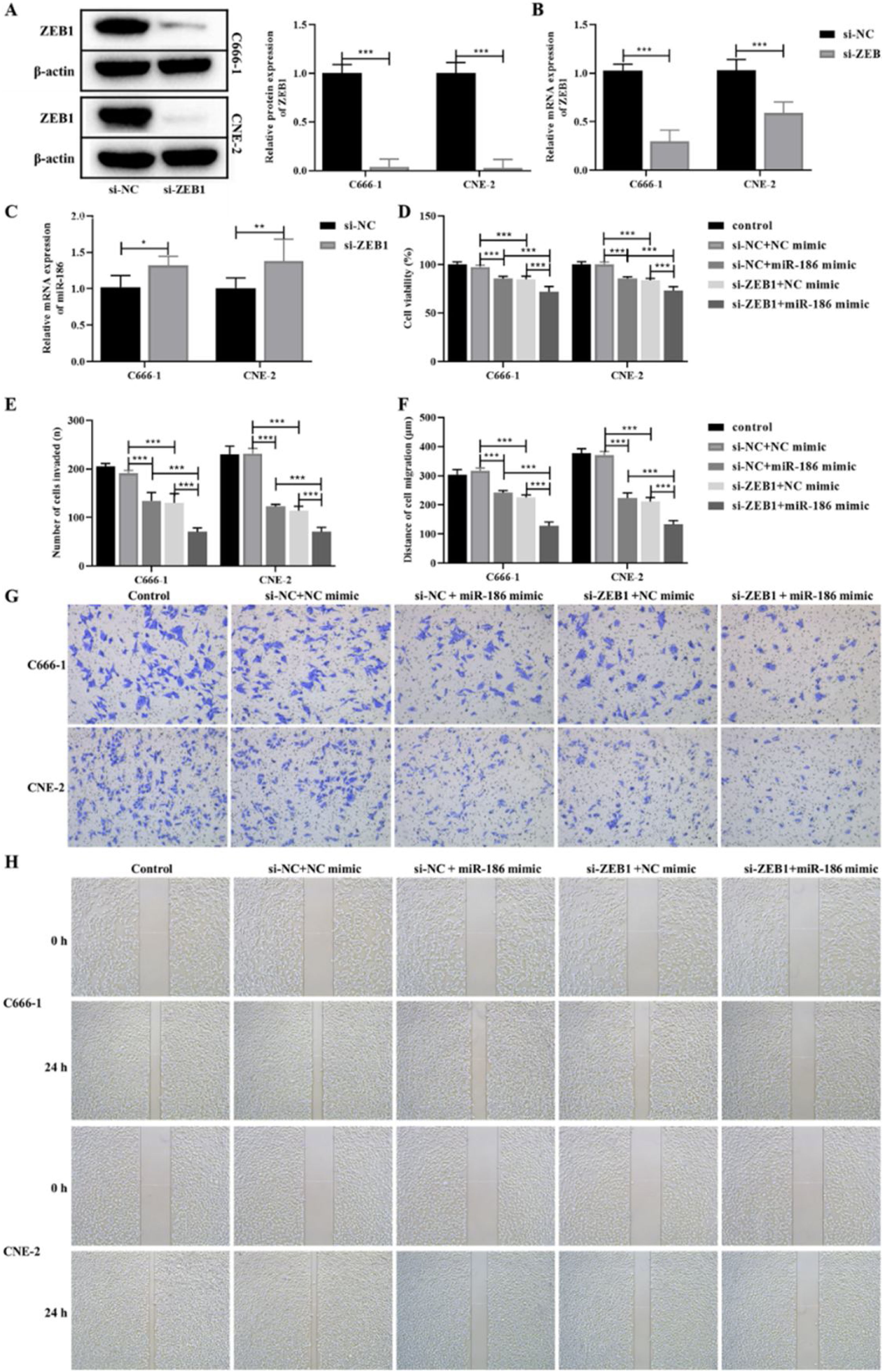 miR-186 regulates epithelial–mesenchymal transformation to promote ...