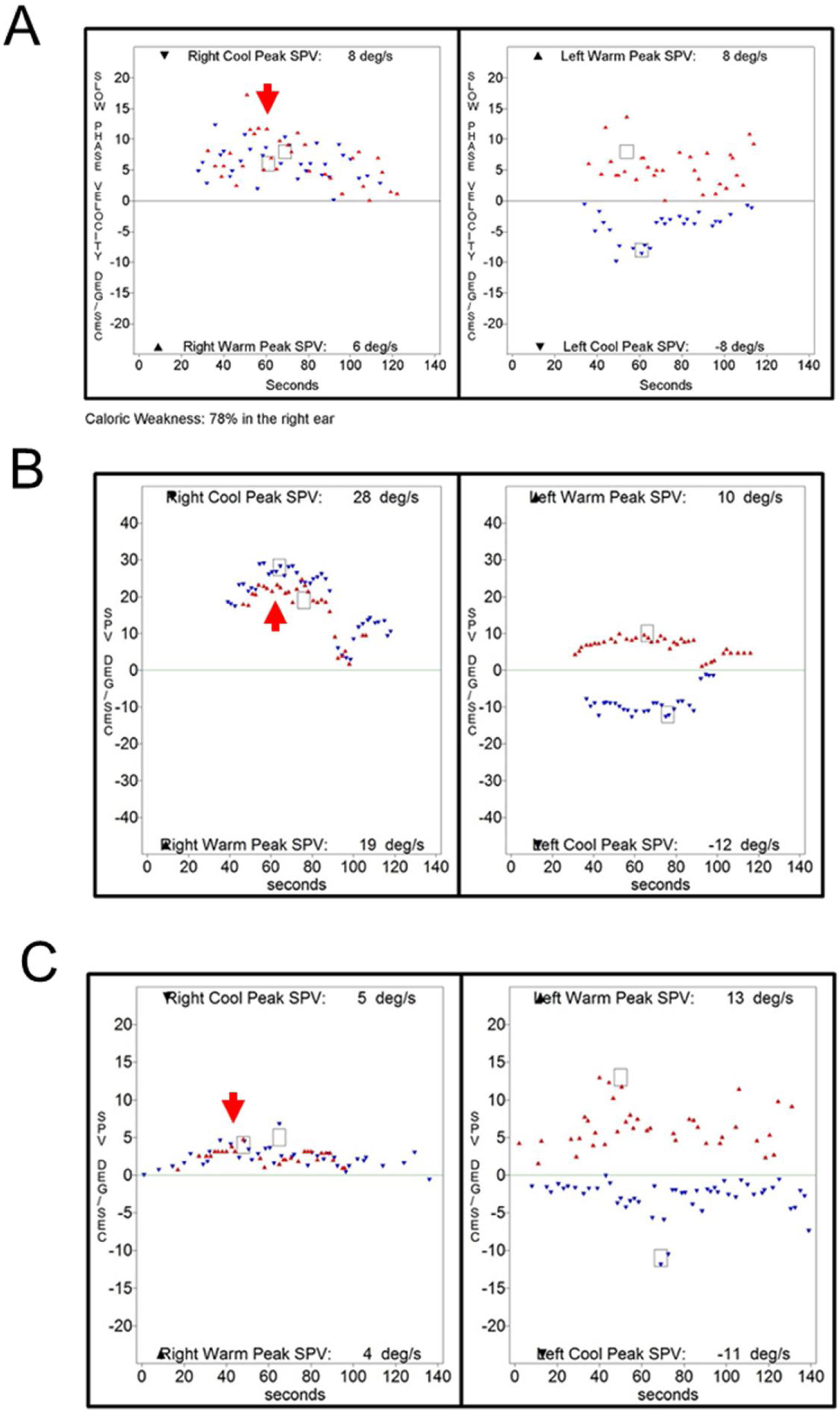 Clinical diagnoses of patients showing caloric inversion | Brazilian ...