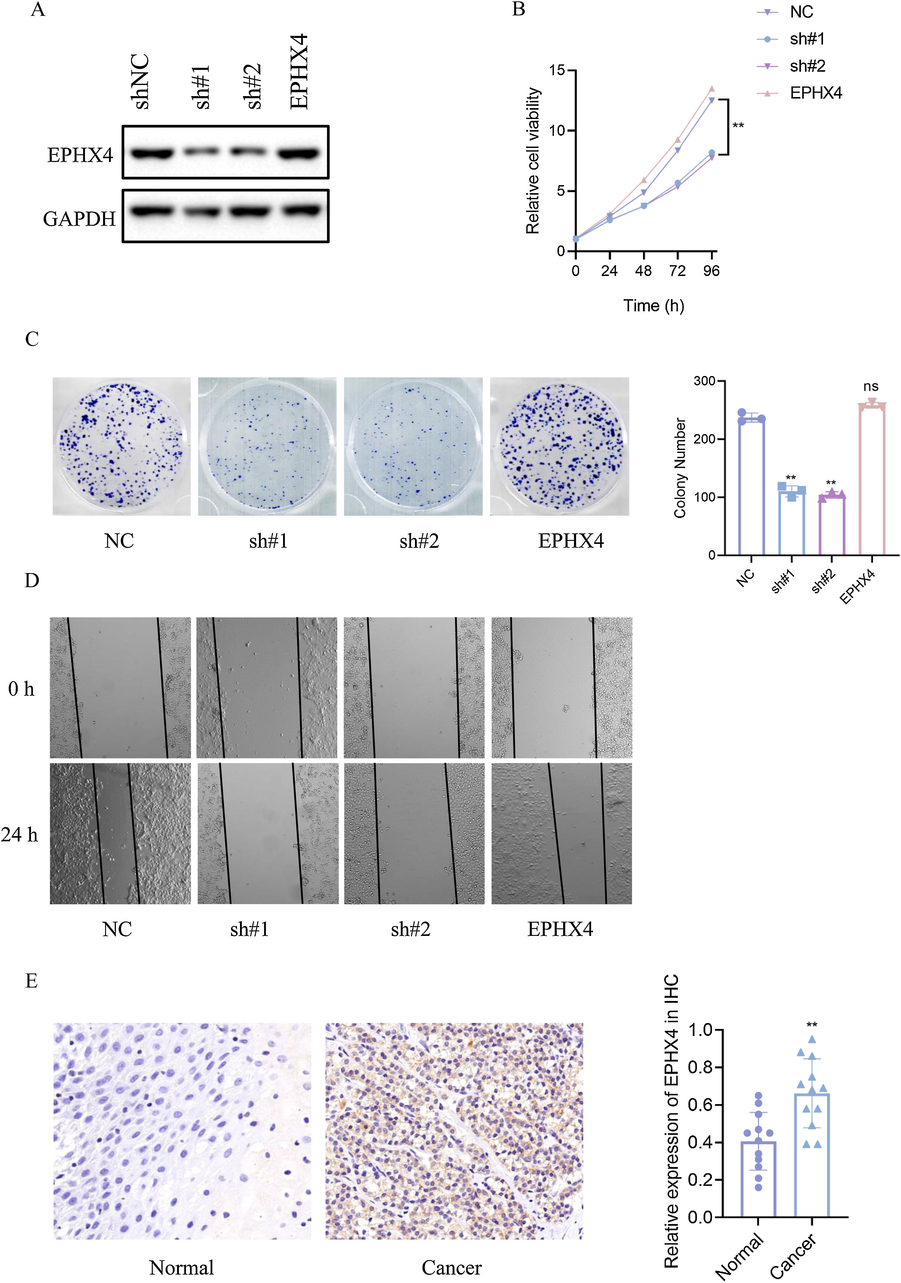 Comprehensive analysis of the immune implication of EPHX4 gene in ...