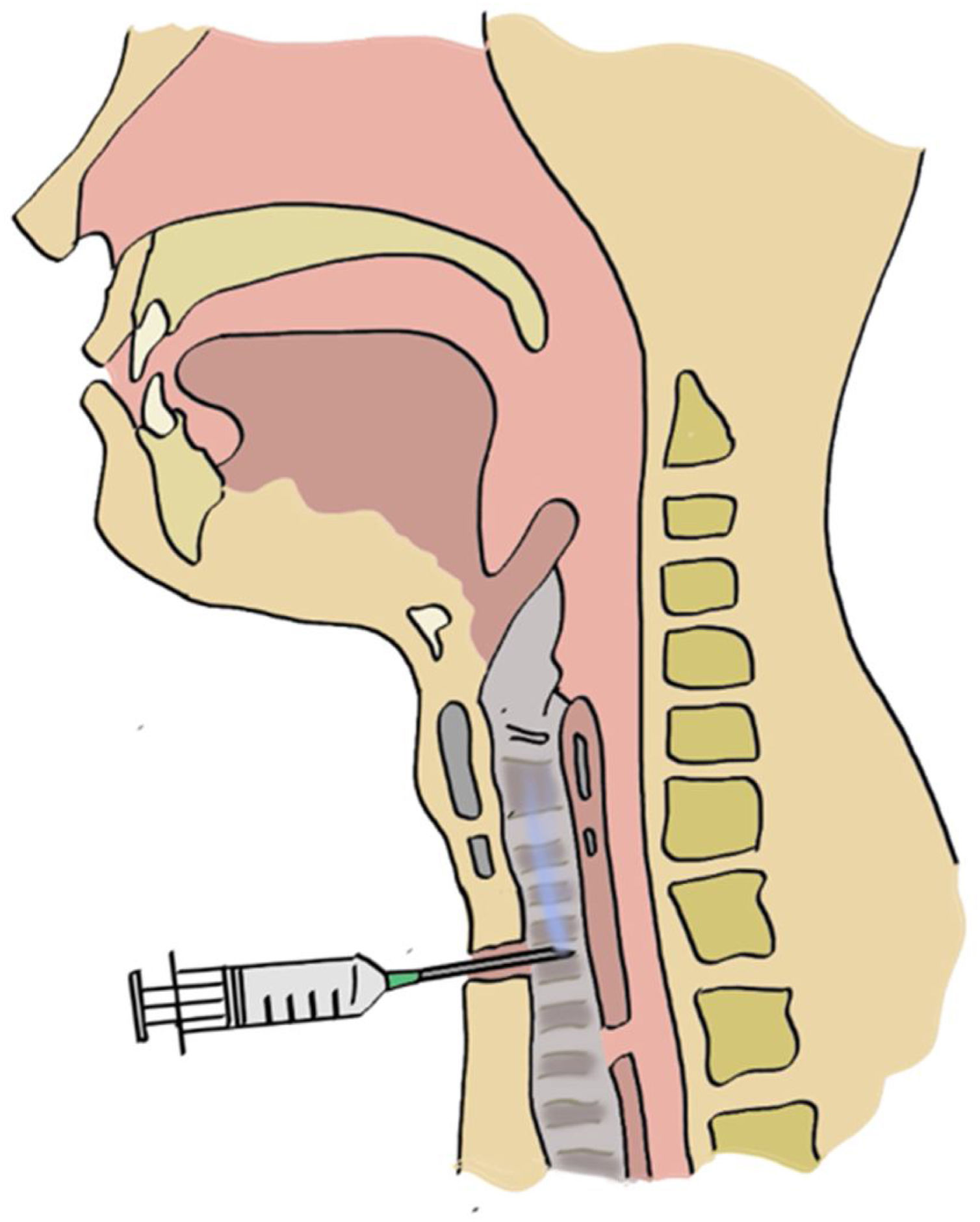 Office based non-invasive diagnostic technique for acquired ...