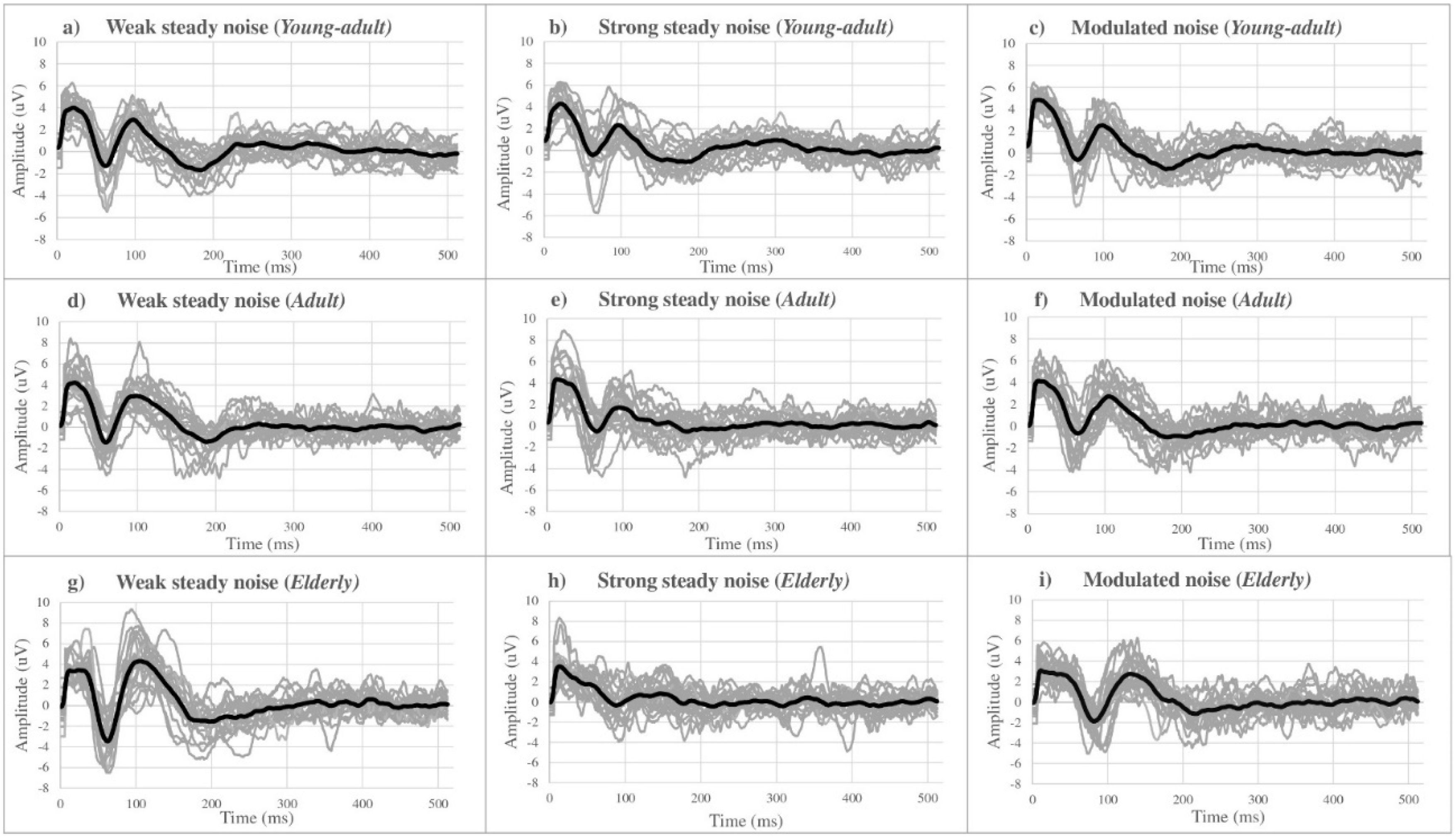 Benefit of Modulated Masking in hearing according to age | Brazilian ...