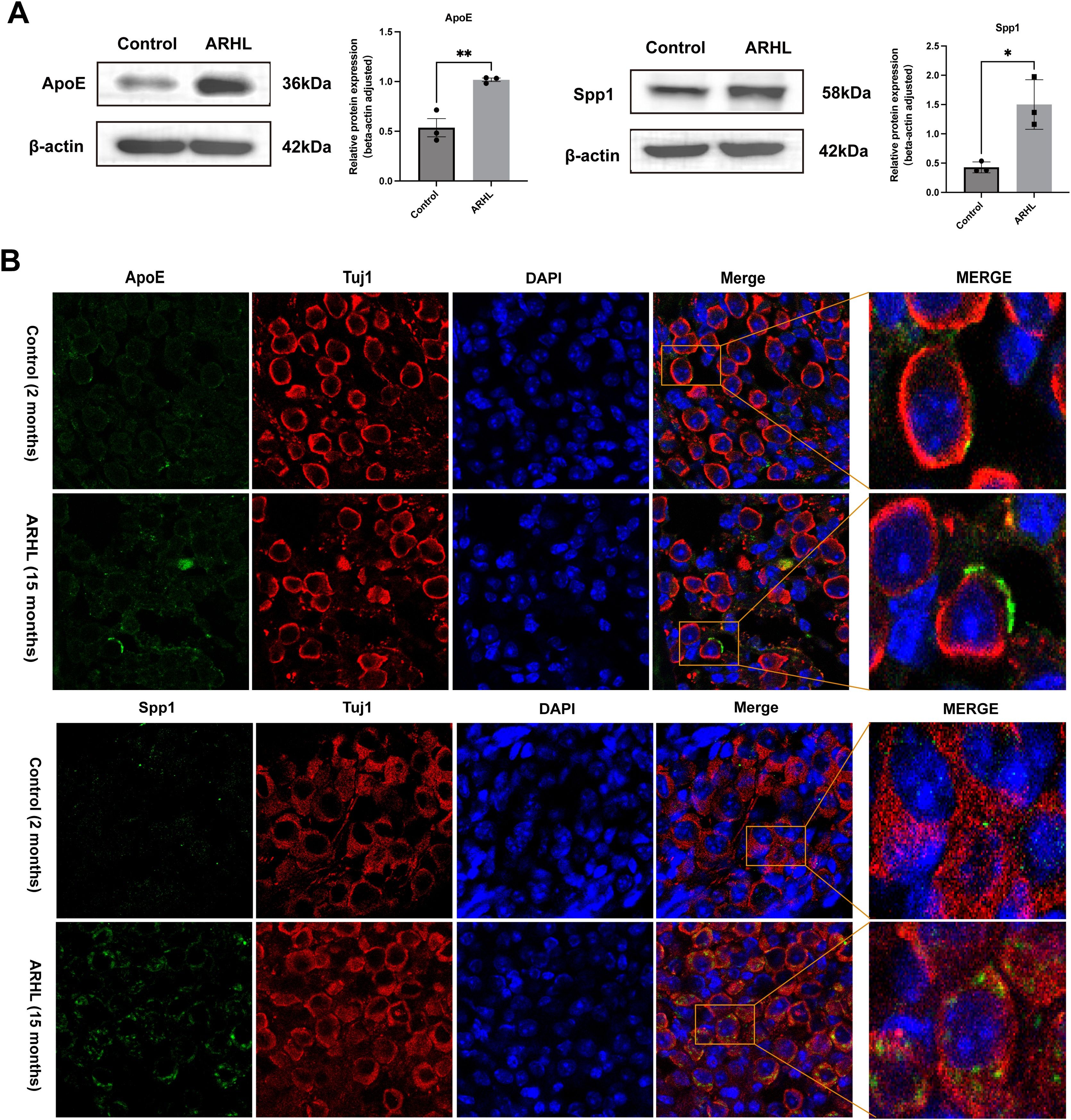 Expression of ApoE and Spp1 in the cochlea and auditory cortex of age ...