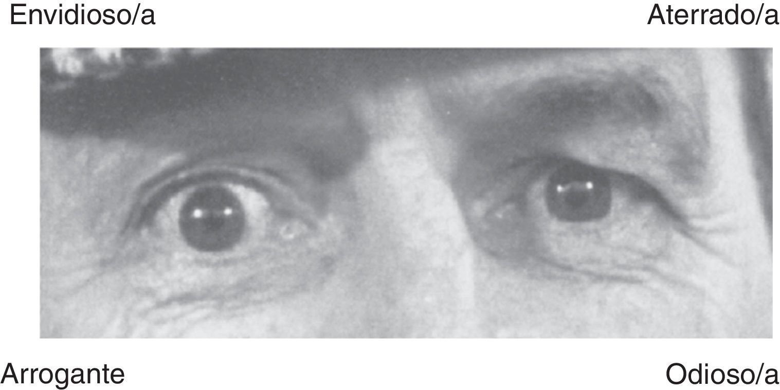 Mecanismo de simulación en demencia frontotemporal variante conductual ...