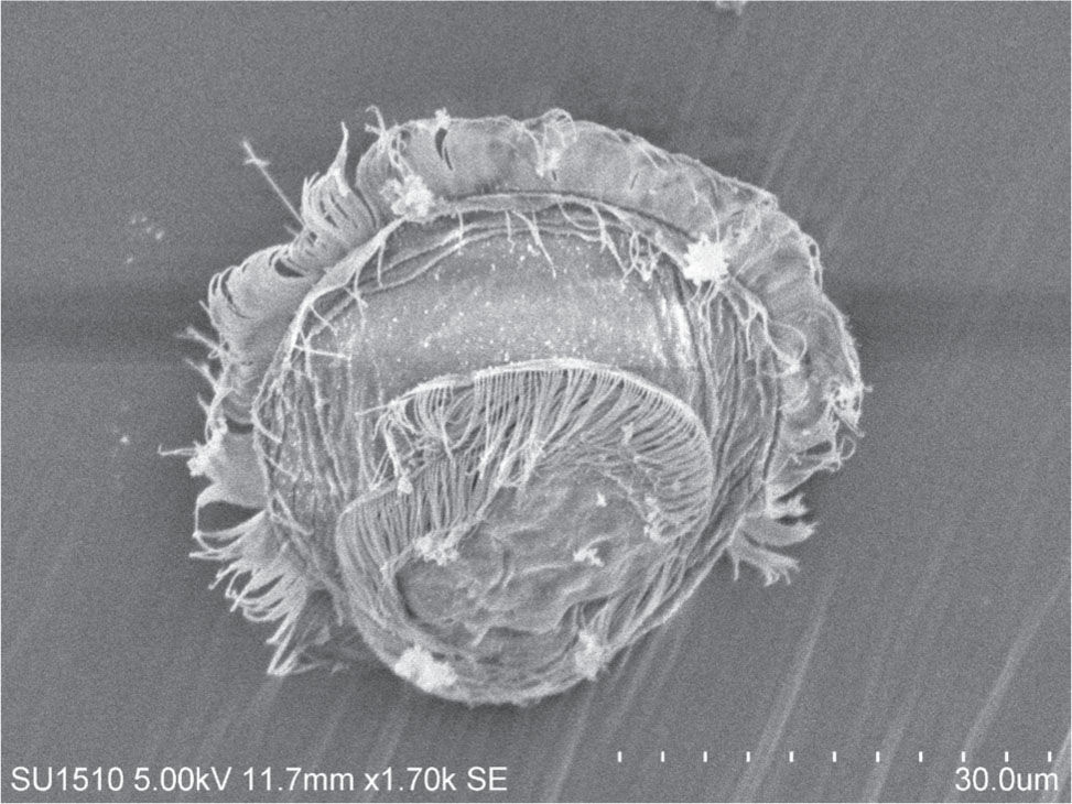 Trichodina mutabilis (Protozoa: Ciliophora: Trichodinidae) from the ...