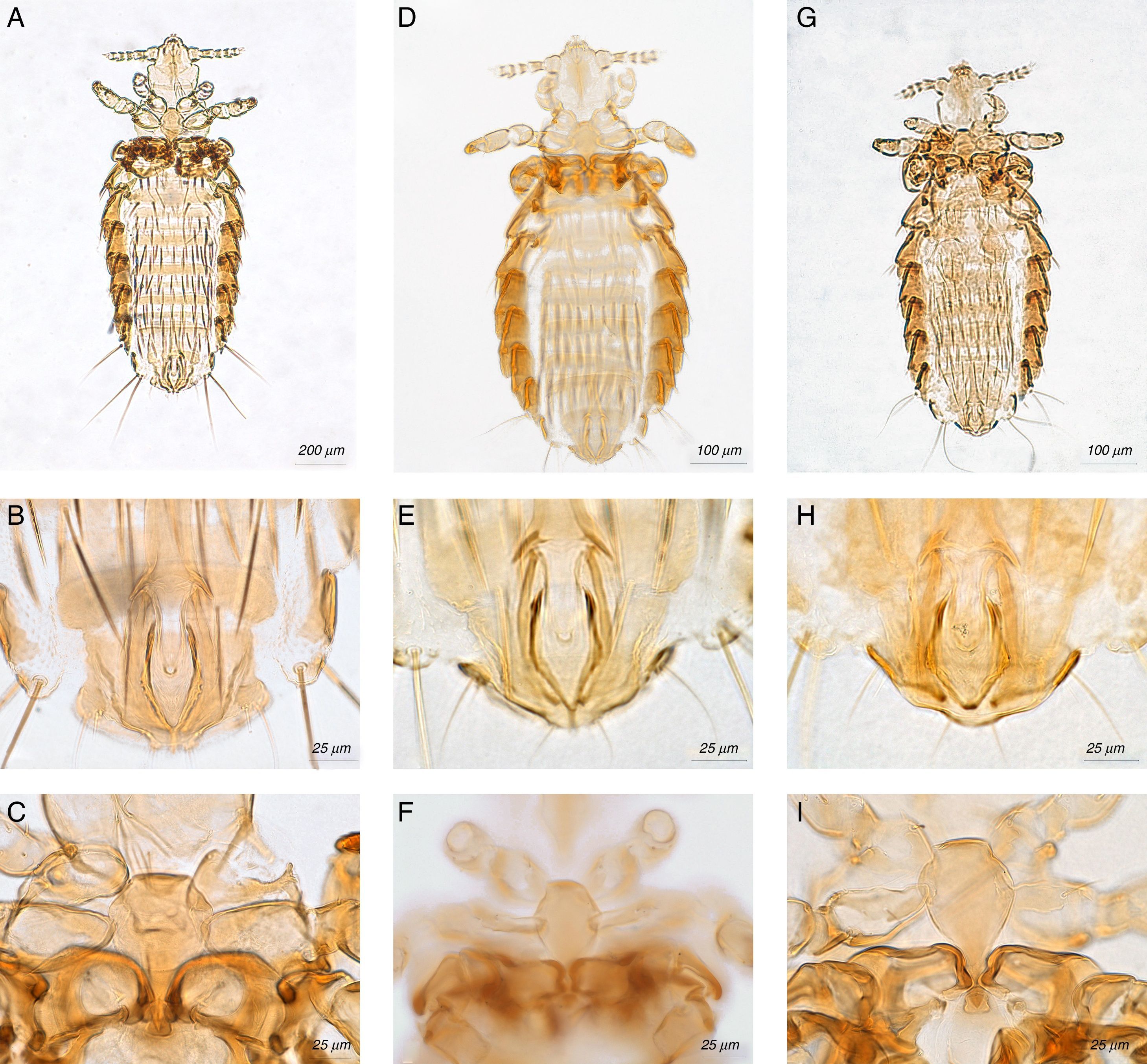 Anoplurans (Insecta: Psocodea: Anoplura) associated with rodents ...