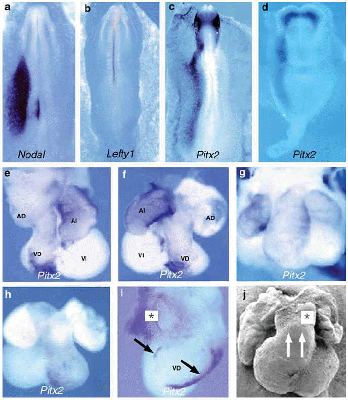 Congenital Heart Disease, Heterotaxia and Laterality | Revista Española ...