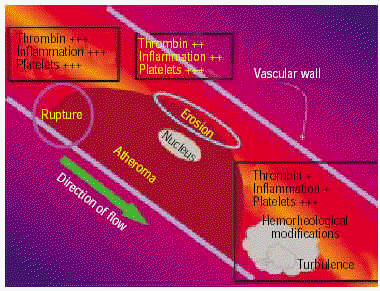 Role of Anti-Inflammatory Drugs in the Treatment of Acute Coronary ...