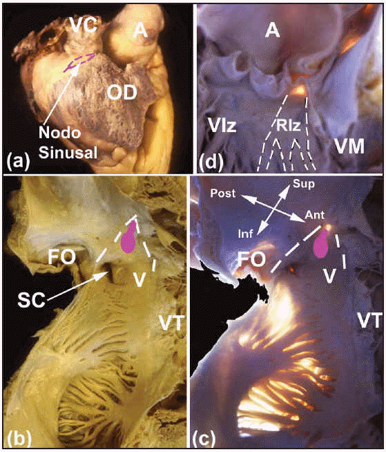 Anatomy of Cardiac Nodes and Atrioventricular Specialized Conduction ...