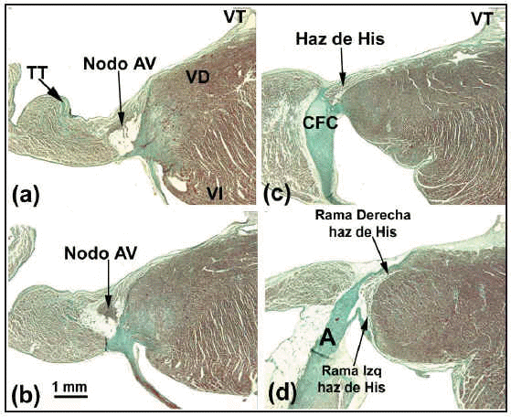 atrioventricular bundle function