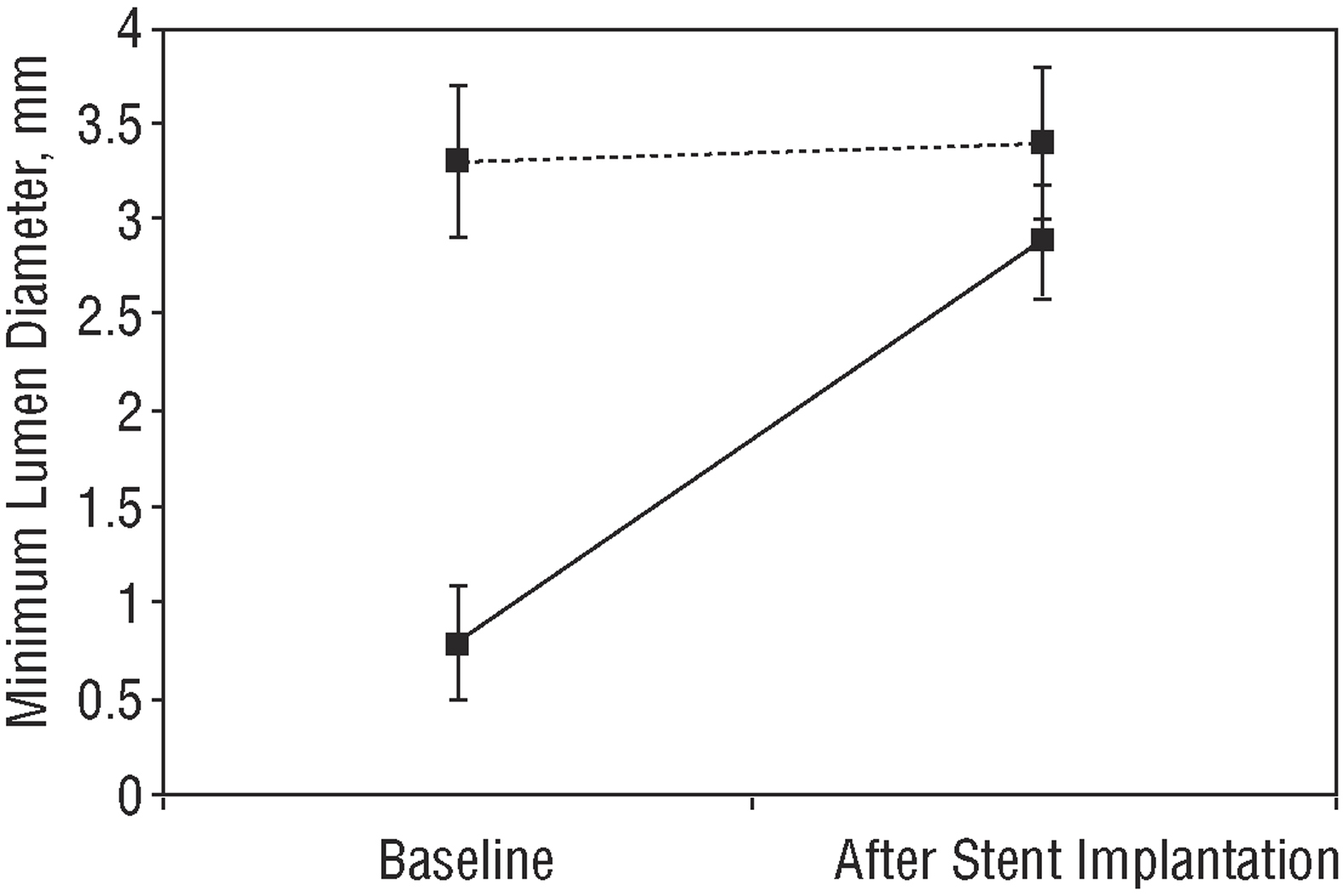 Immediate and Long-Term Outcome After Angioplasty With Stenting of the ...