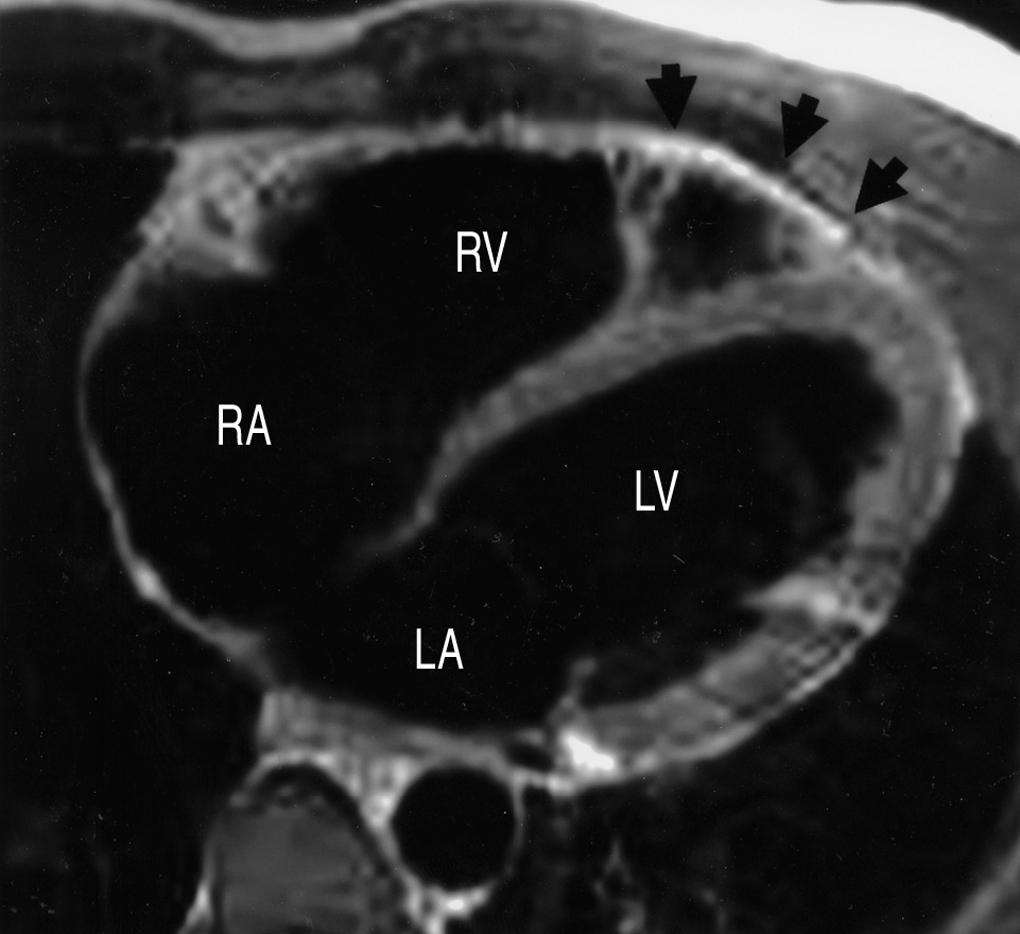 Clinical Value of Cardiovascular Magnetic Resonance Imaging in the ...