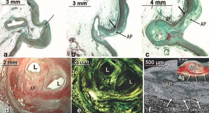 Structural Features of the Sinus of Valsalva and the Proximal Portion ...