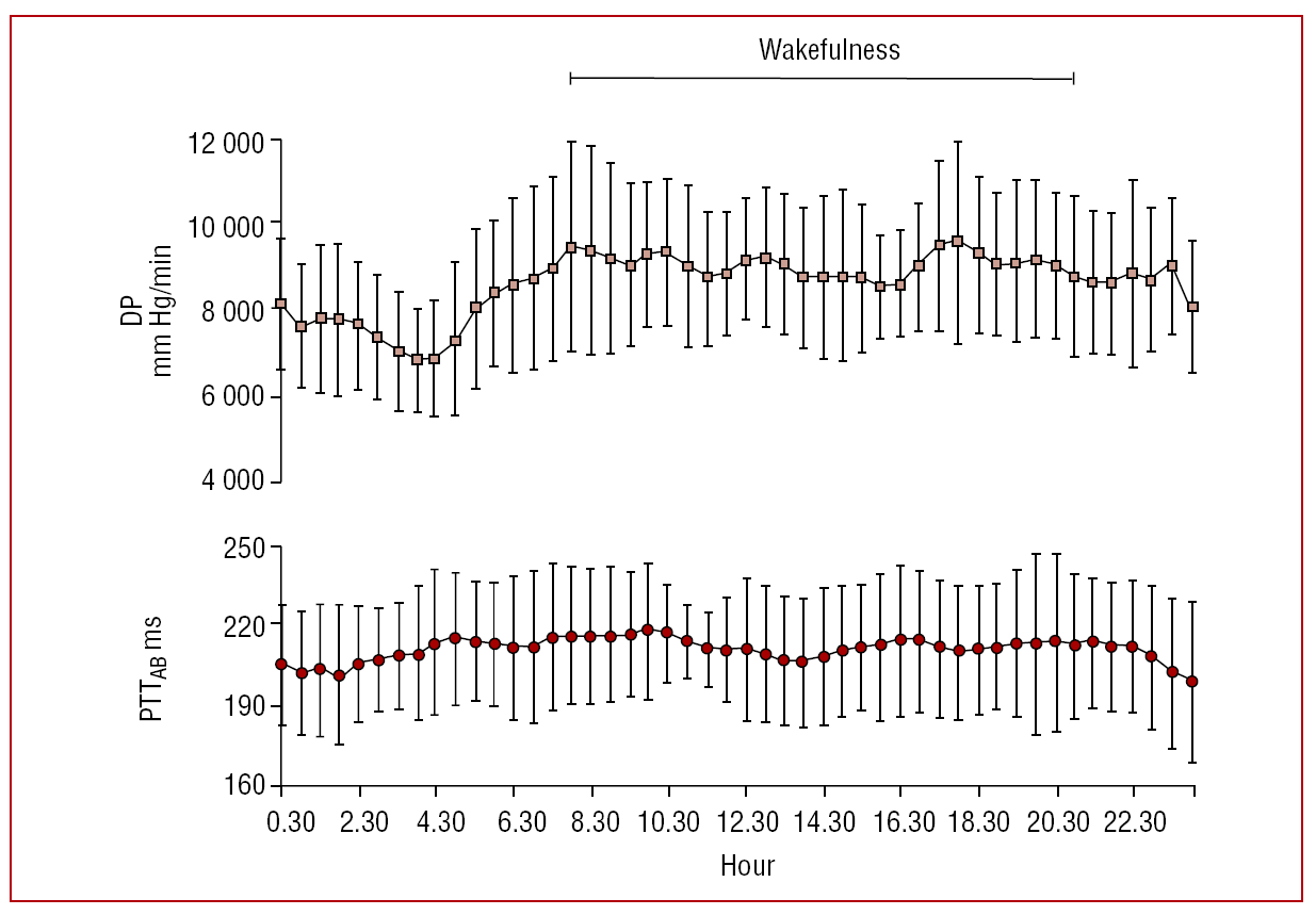 Sleep-­Wakefulness Variations in Arterial Stiffness: Assessment Using ...