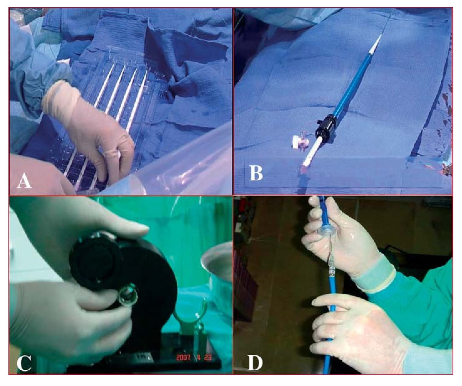 Percutaneous Aortic Valve Implantation: Initial Experience in Spain ...