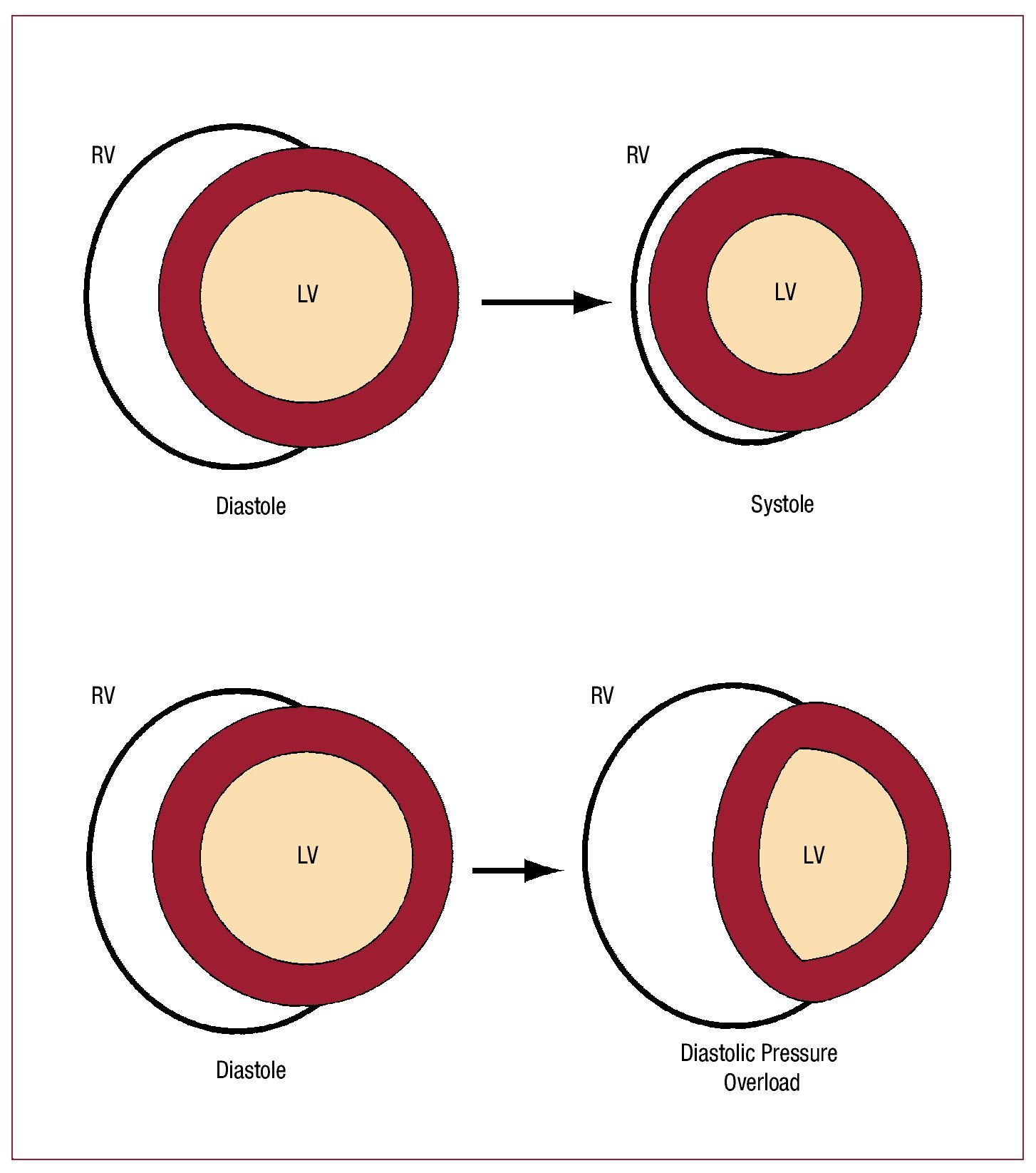 The Right Ventricle and Pulmonary Circulation: Basic Concepts | Revista ...