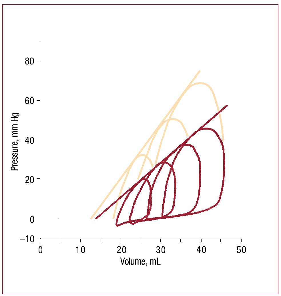 The Right Ventricle and Pulmonary Circulation: Basic Concepts | Revista ...