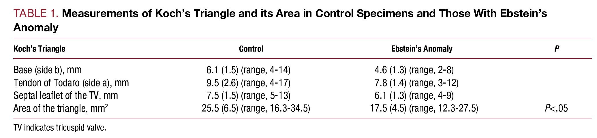 Koch's Triangle and the Atrioventricular Node in Ebstein's Anomaly ...