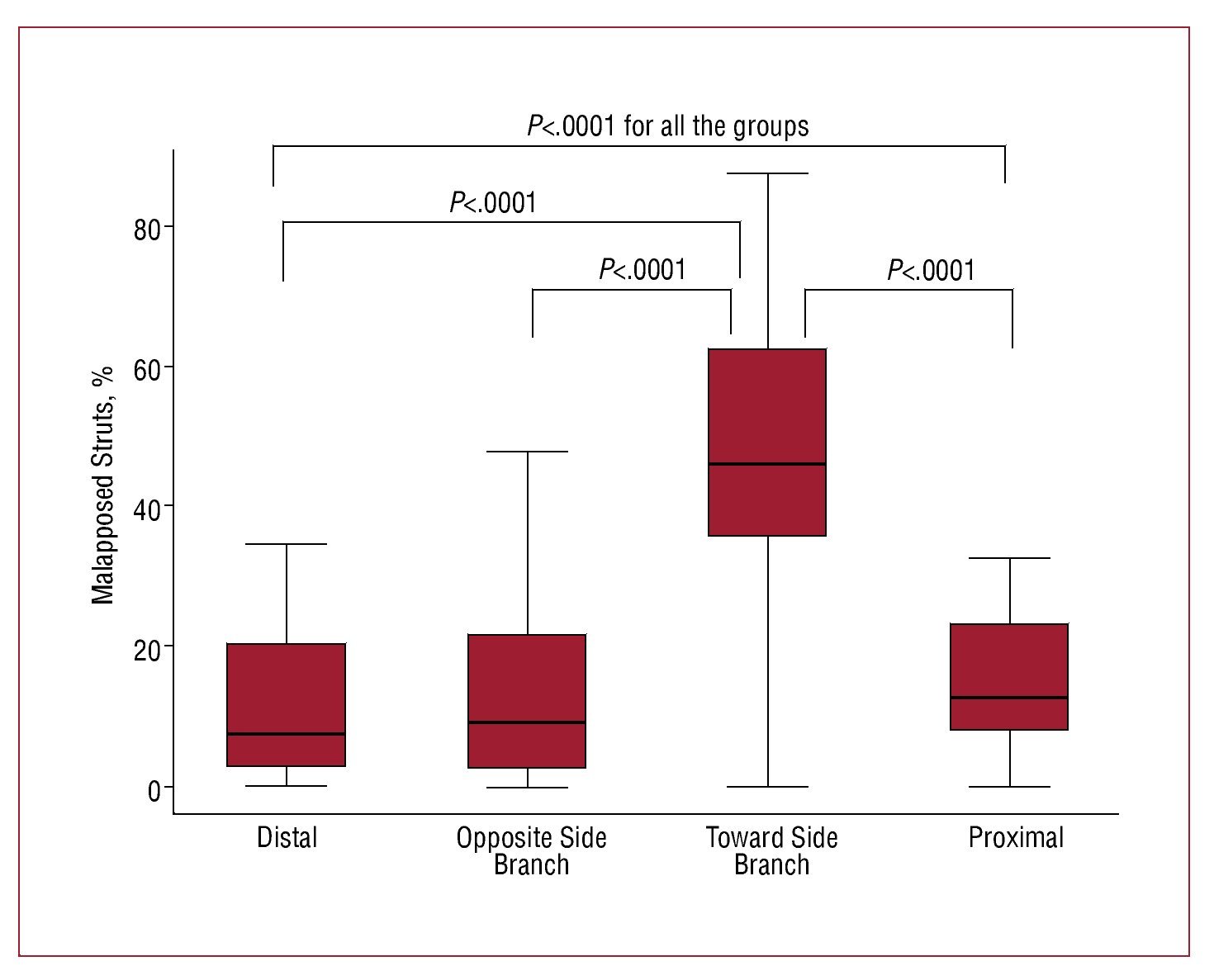 Simple Versus Complex Approaches to Treating Coronary Bifurcation ...