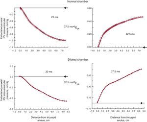 Right and Left Ventricular Diastolic Flow Field: Why Are Measured ...