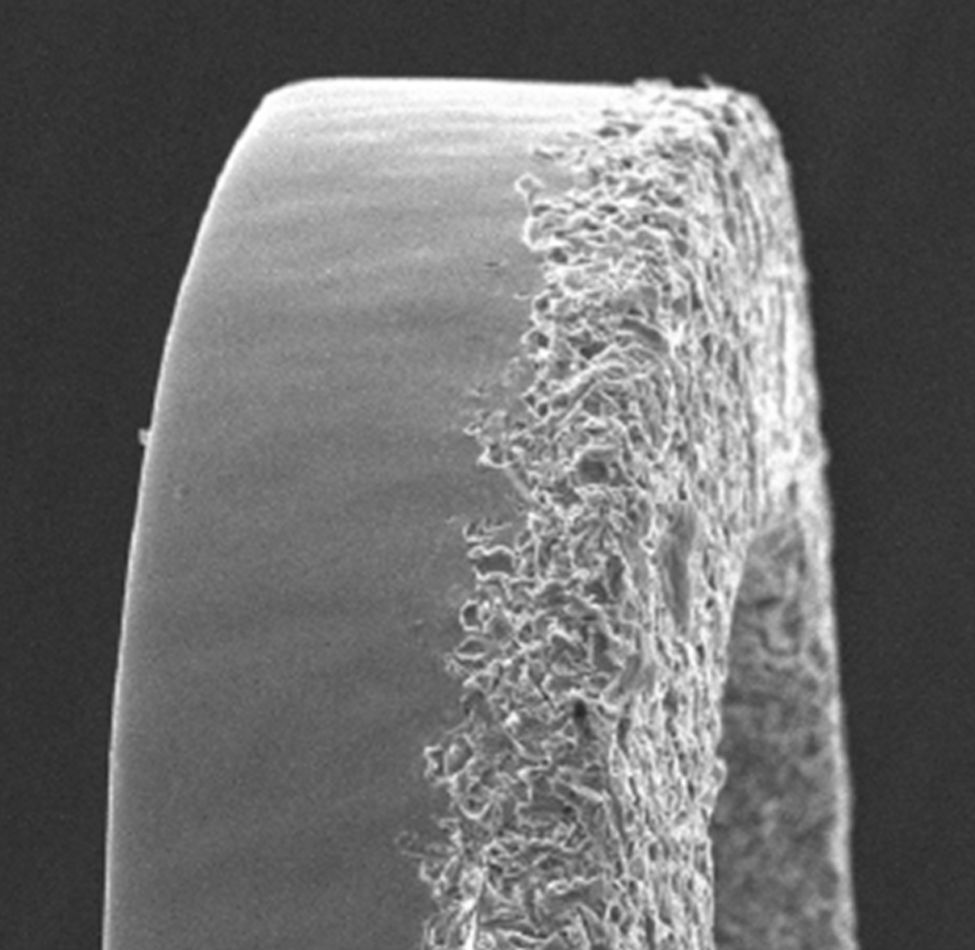 Progress in Treatment by Percutaneous Coronary Intervention: The Stent ...