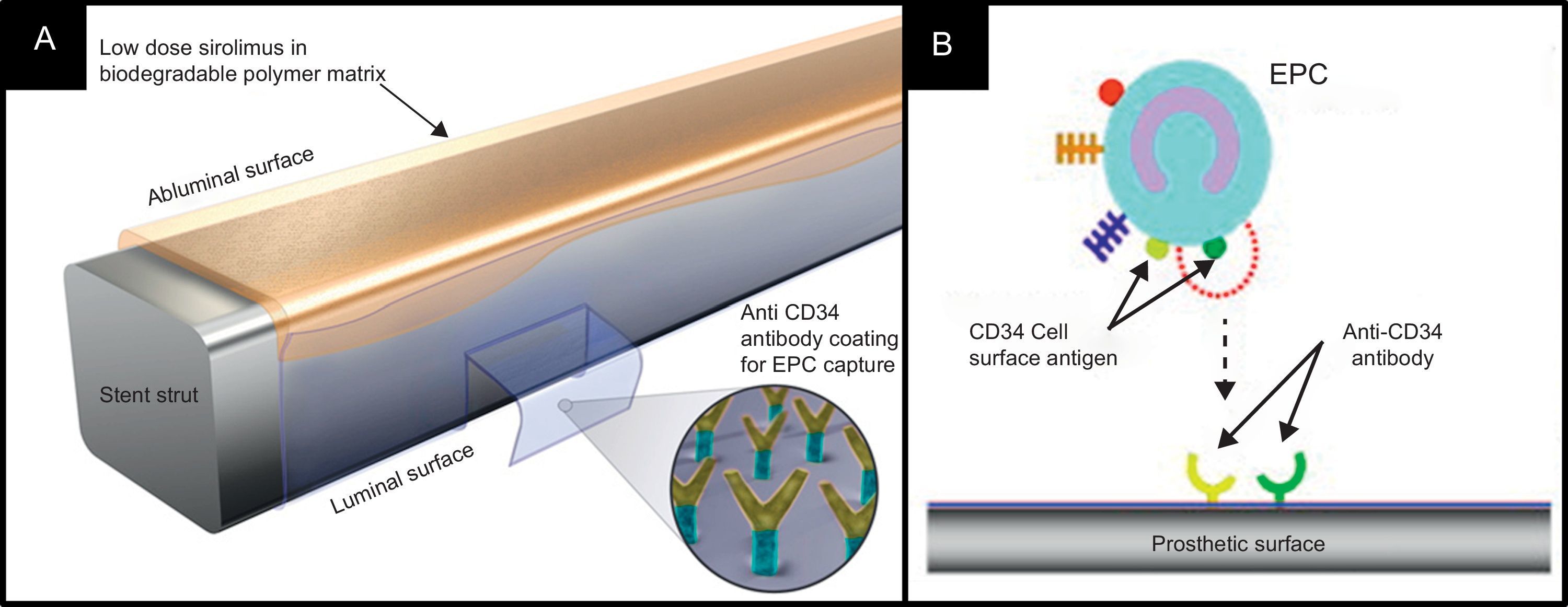 Progress in Treatment by Percutaneous Coronary Intervention: The Stent ...