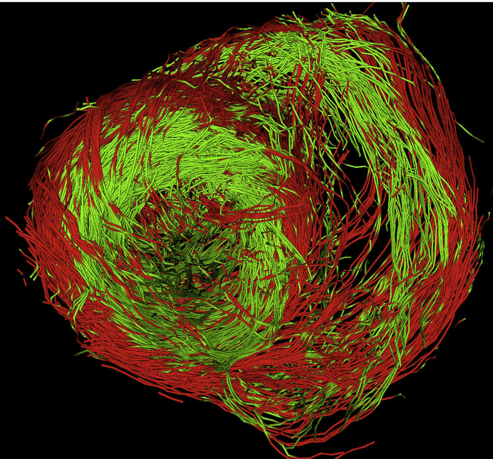 Helical Structure of the Cardiac Ventricular Anatomy Assessed by ...
