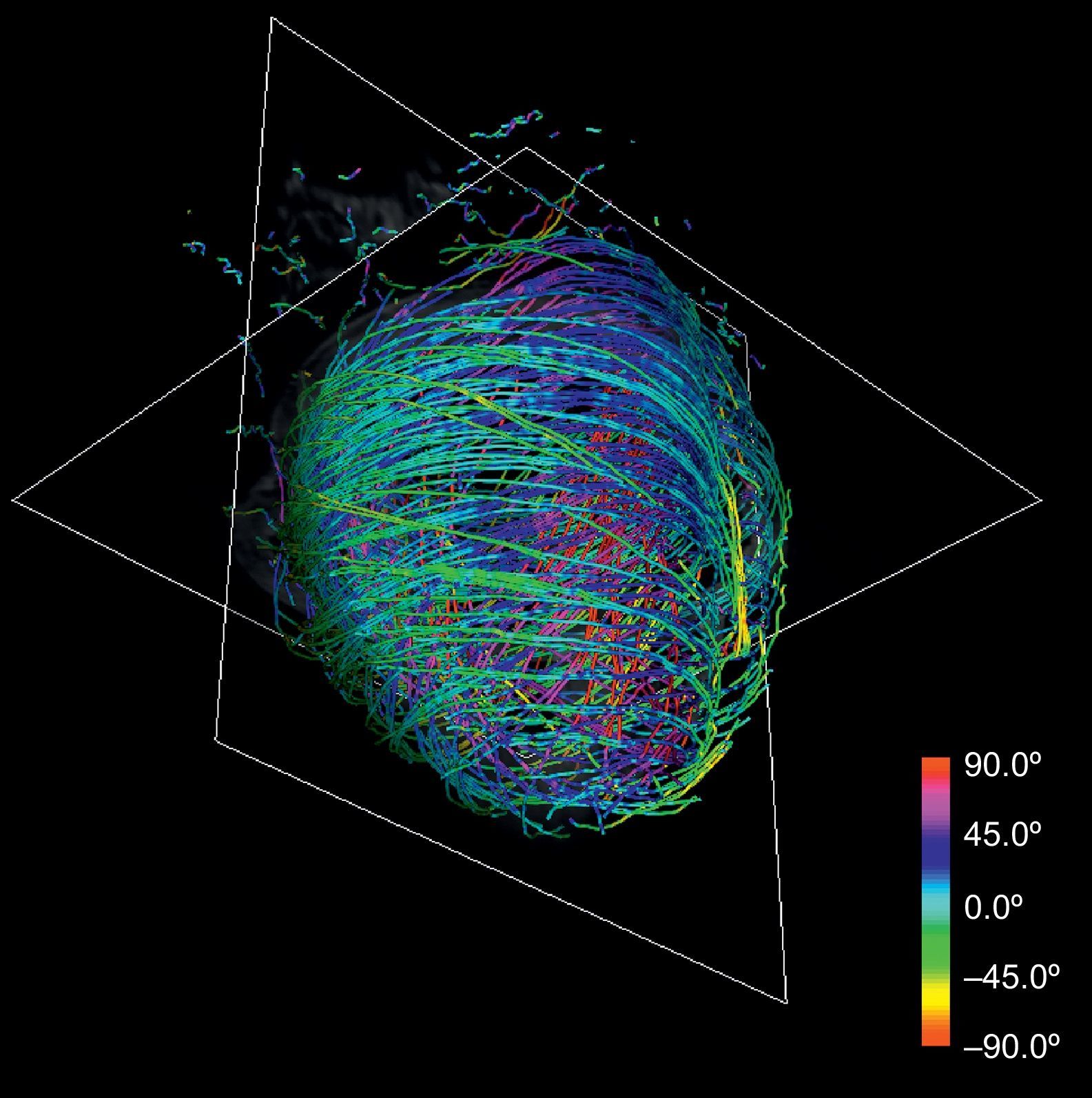Helical Structure of the Cardiac Ventricular Anatomy Assessed by ...