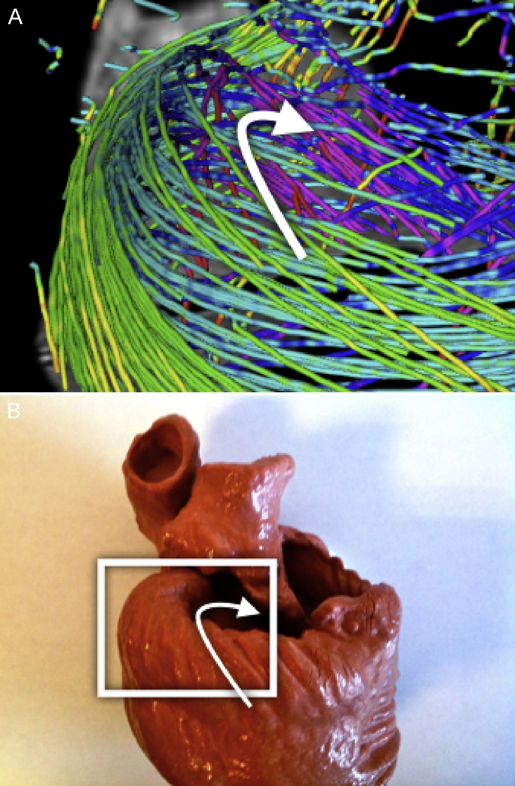 Helical Structure of the Cardiac Ventricular Anatomy Assessed by ...