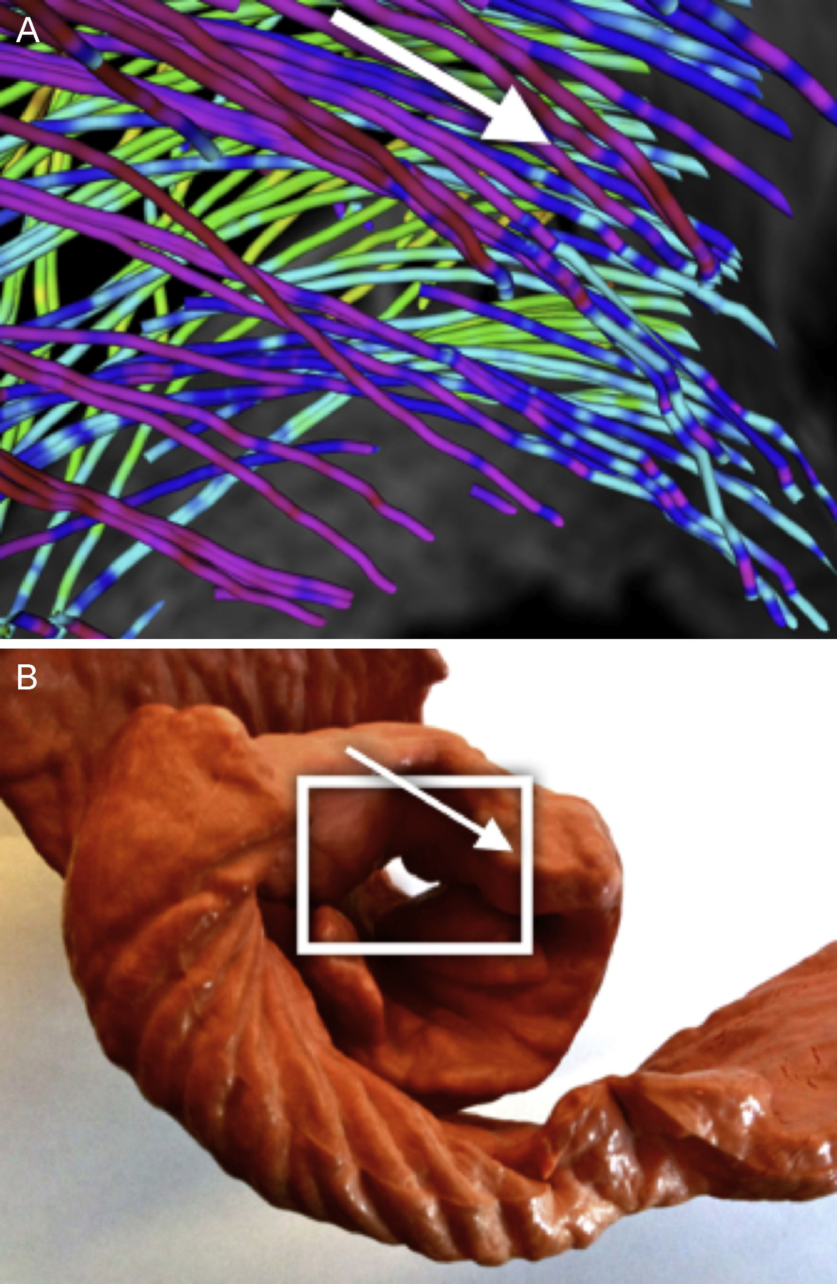 Helical Structure of the Cardiac Ventricular Anatomy Assessed by ...