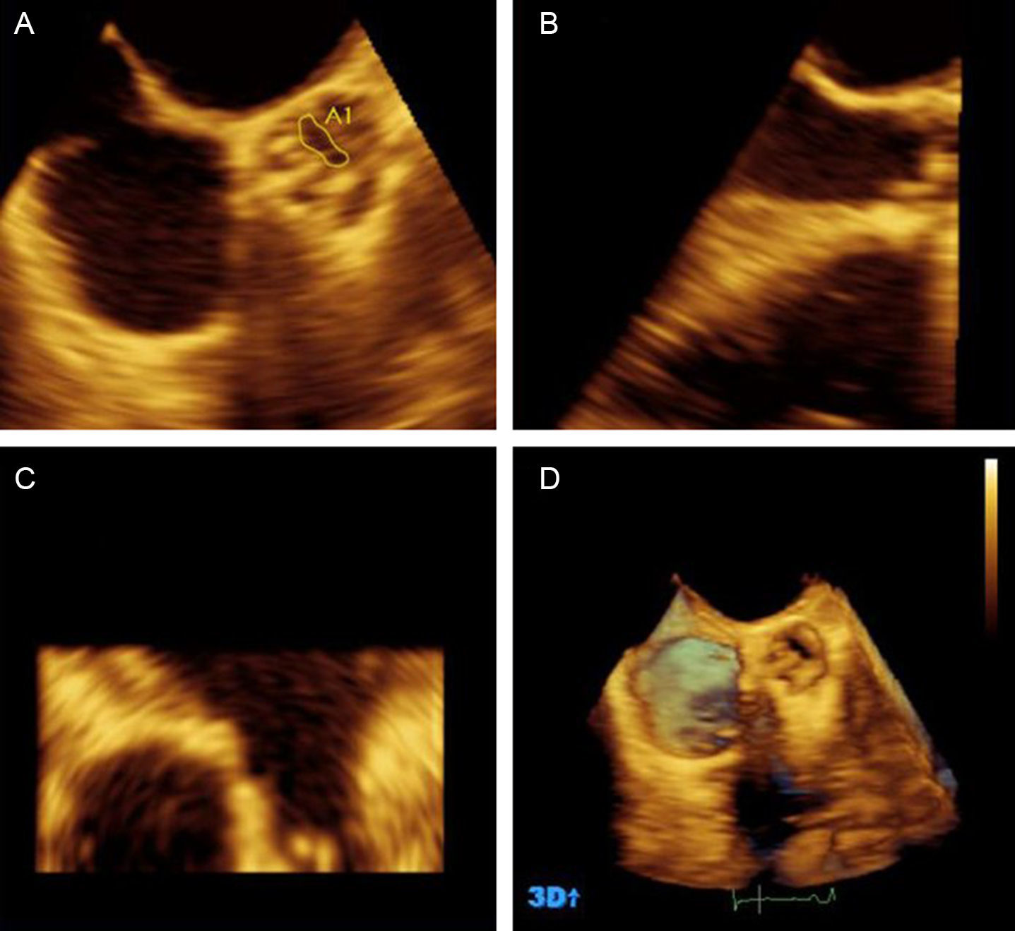 Update on Cardiac Imaging Techniques 2013 | Revista Española de Cardiología